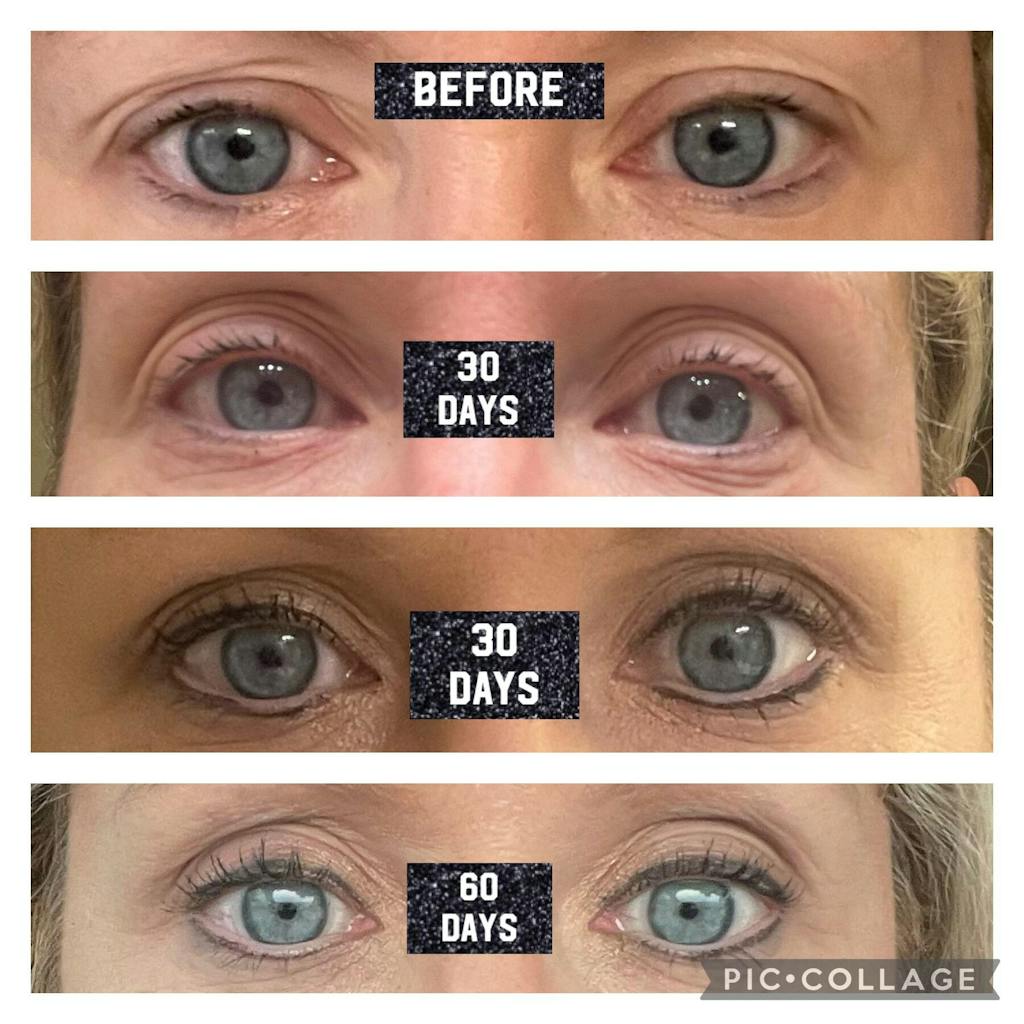 Lash Therapy – Hello Skincare