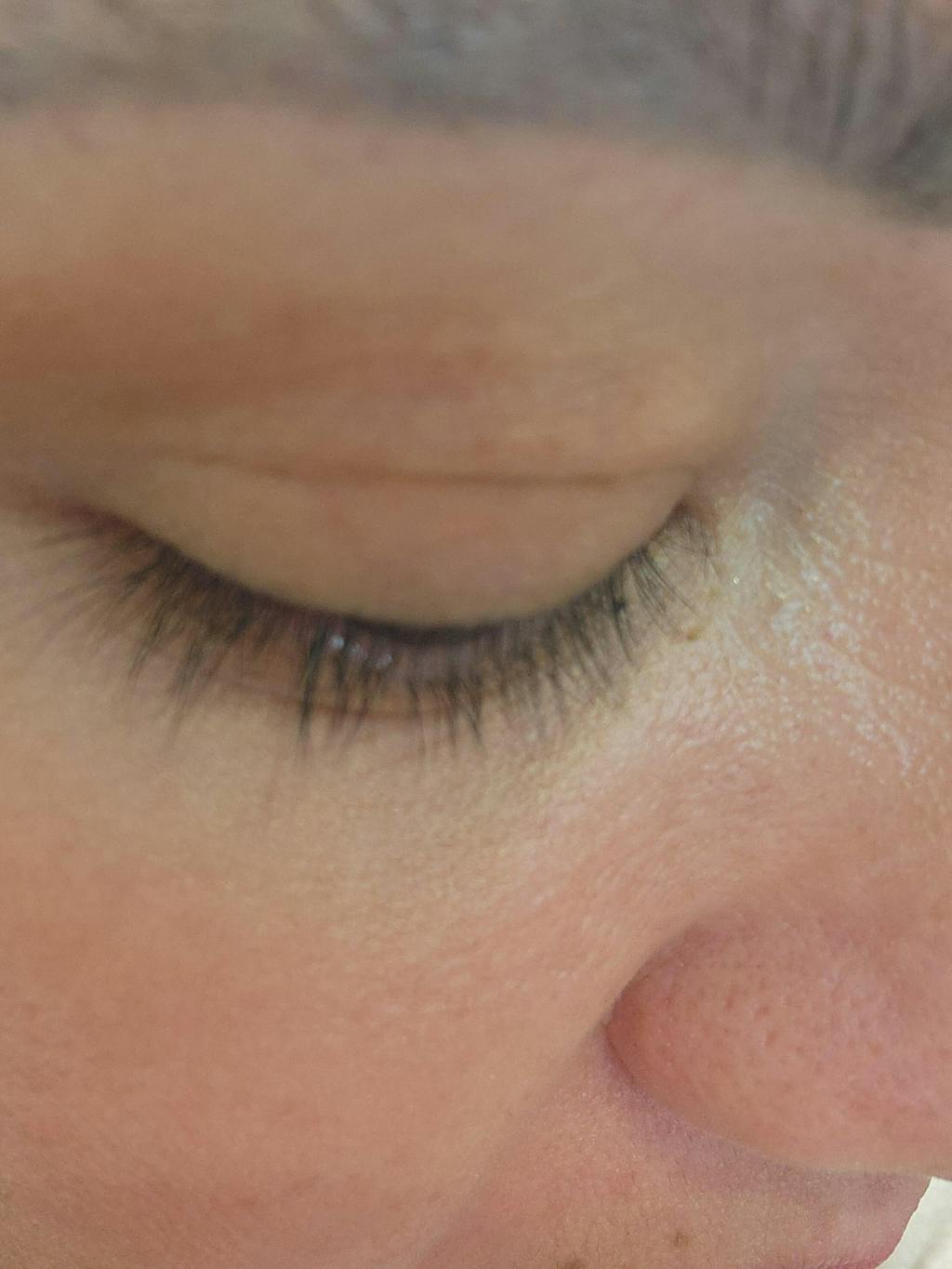 Lash Therapy – Hello Skincare
