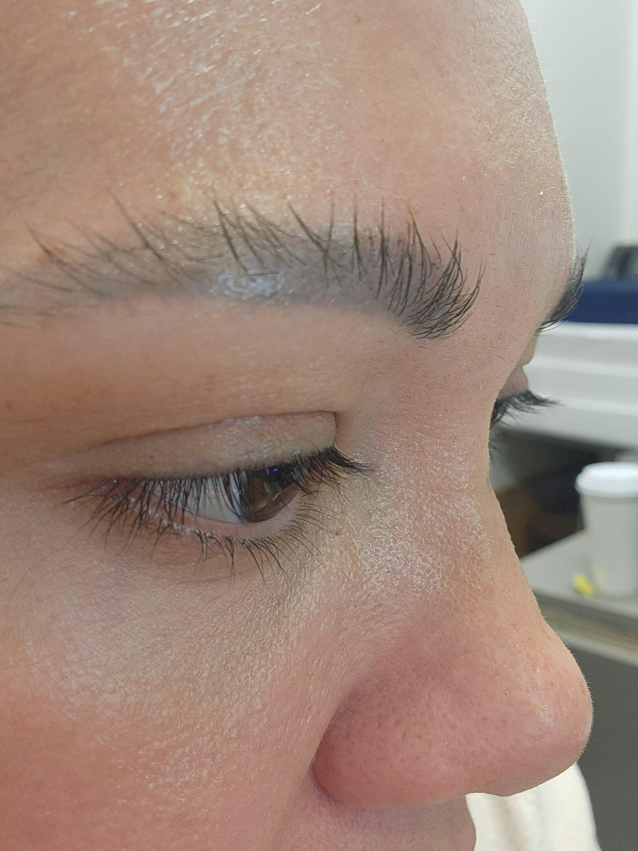 Lash Therapy – Hello Skincare