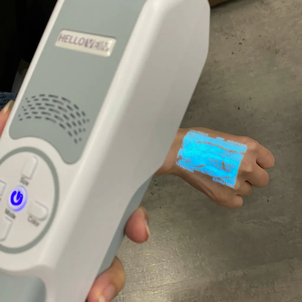 Portable Infrared Vein Finder Machine - Hellovein™