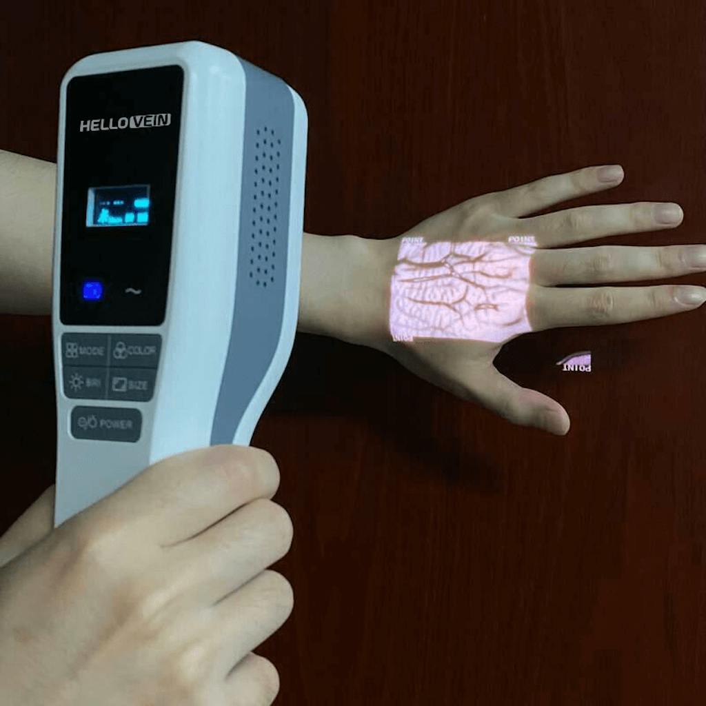 Lite 2.0 Vein Finder Vein Illuminator for IV Access Phlebotomy
