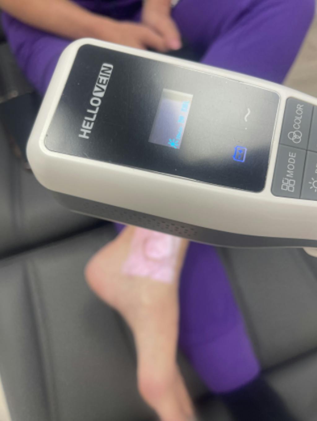 Infrared Vein Finder Wheeled Stand for Vein Viewer/Locator/