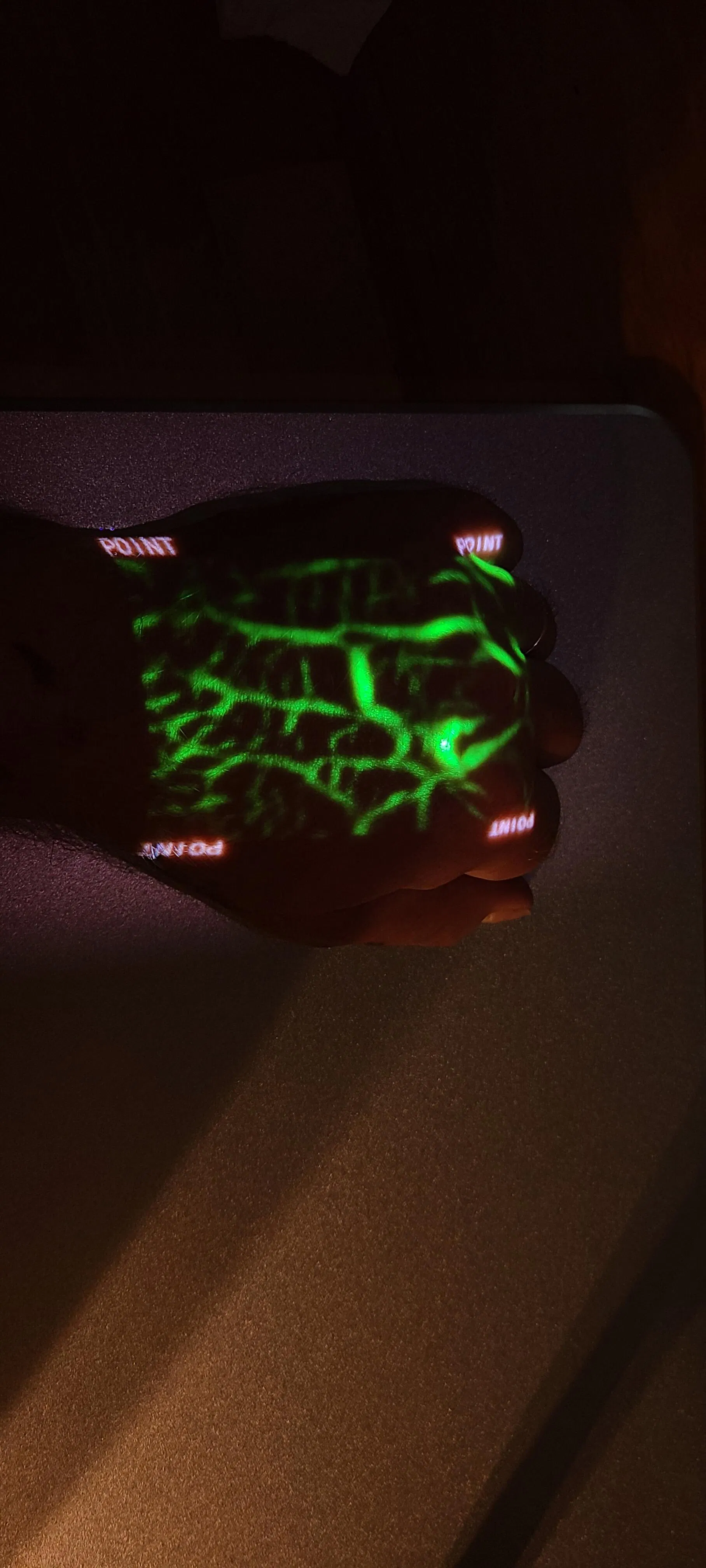 Lite 2.0 Vein Finder Vein Illuminator for IV Access Phlebotomy