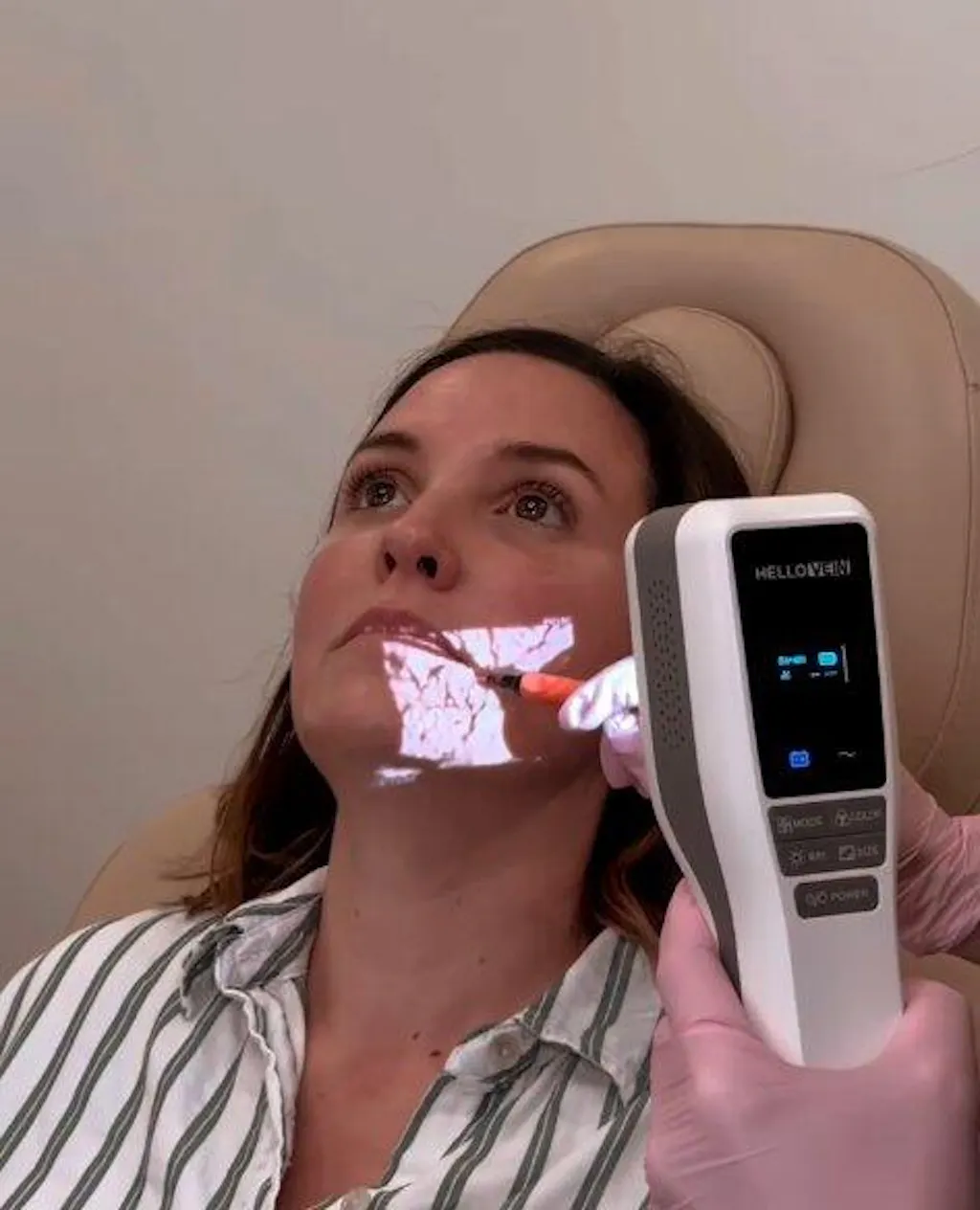 Lite 2.0 Vein Finder Vein Illuminator for IV Access Phlebotomy