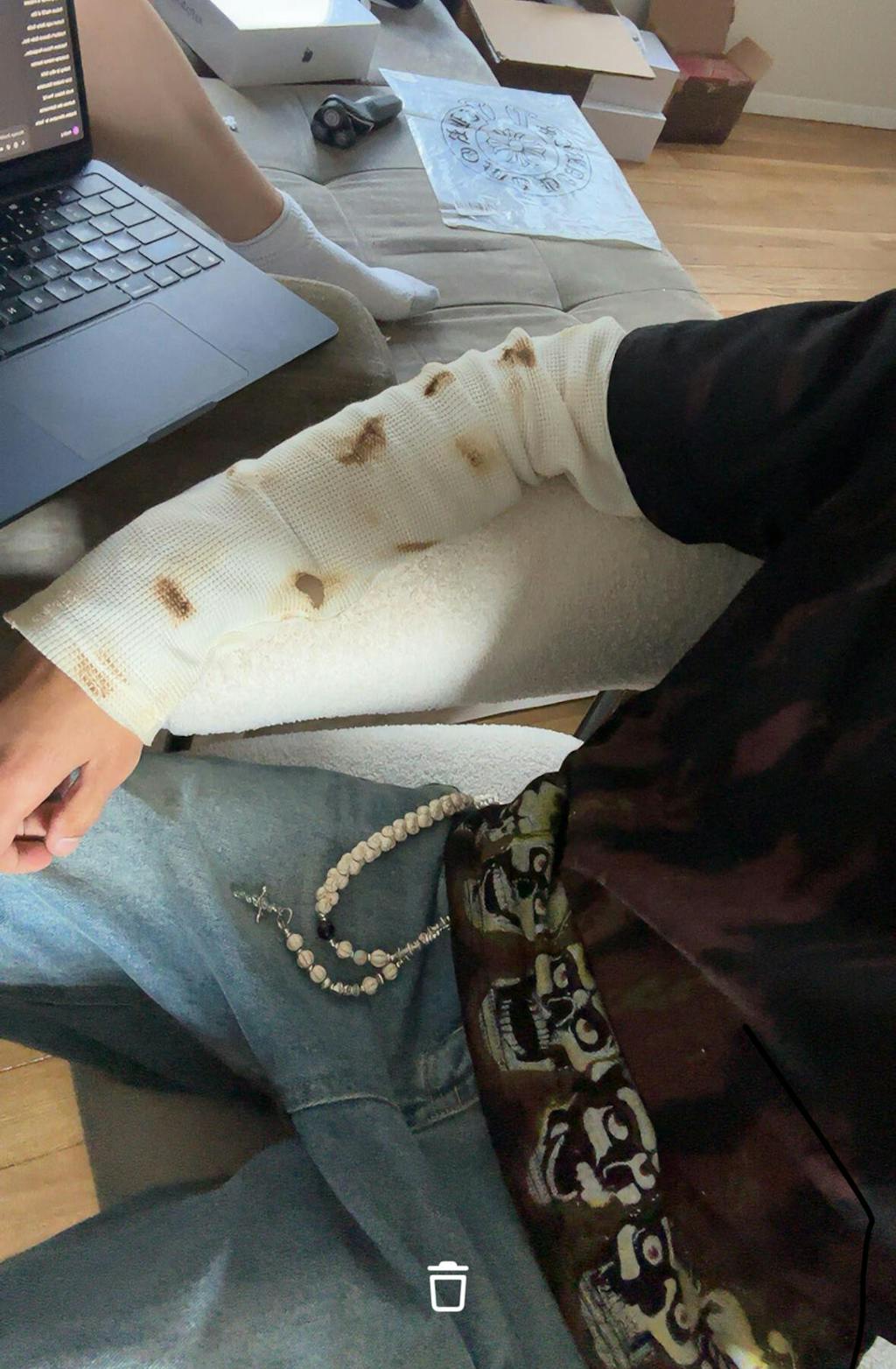 SKELETAL LINK - HOWSS