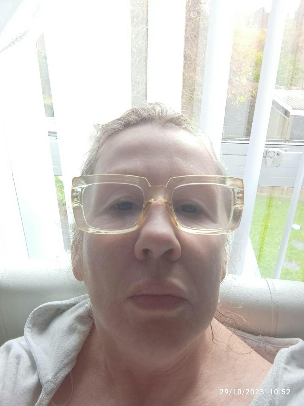 Hyclo Skin Repair - Treatment Gel