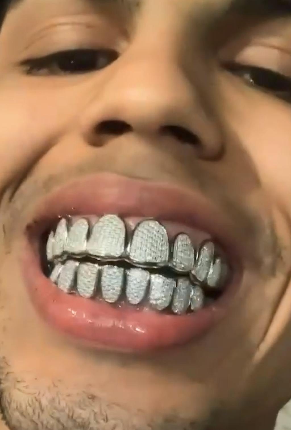 CUSTOM FULLY ICED GRILLZ – ICEGIANT