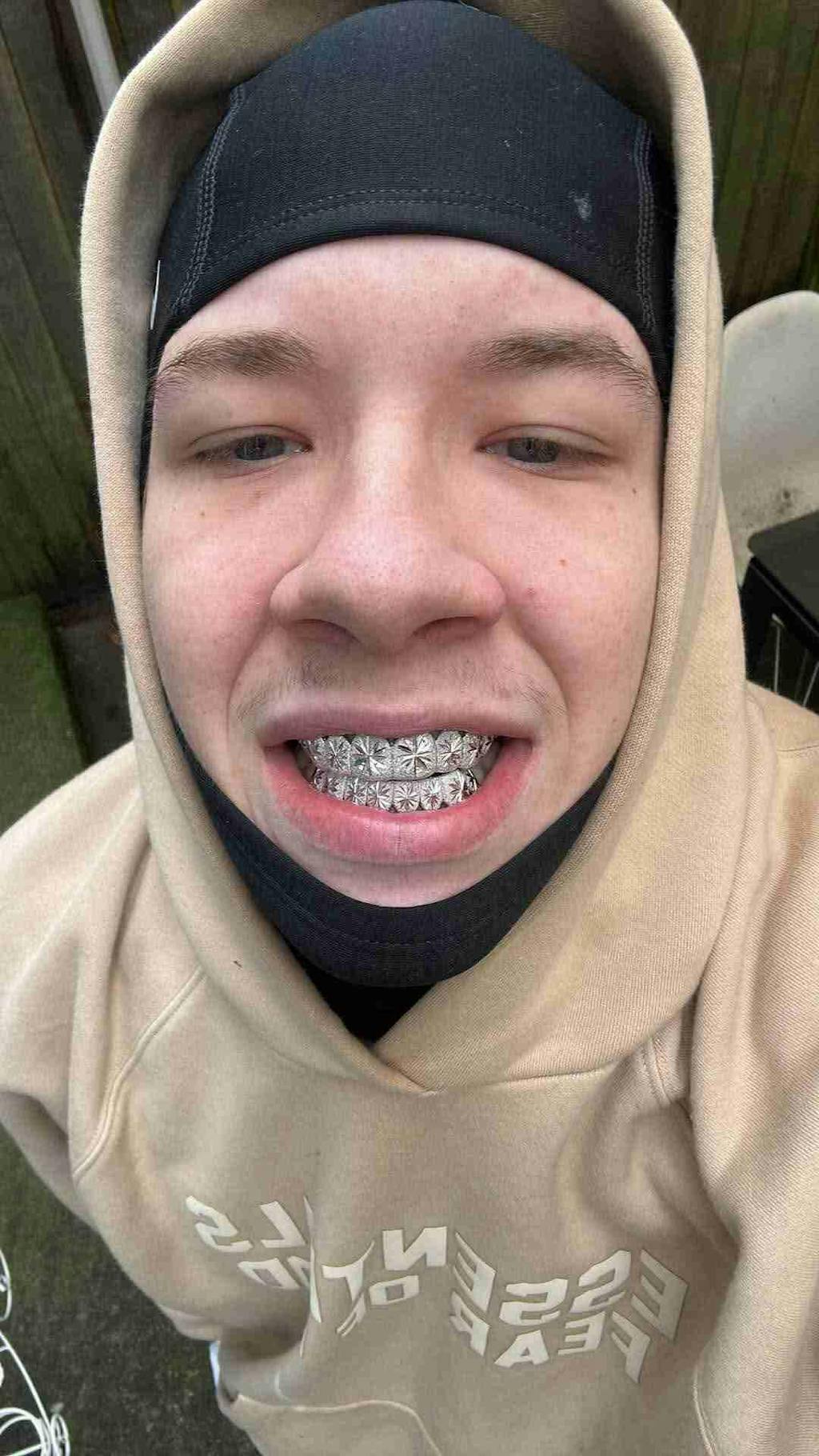 Solid Grillz – ICEGIANT