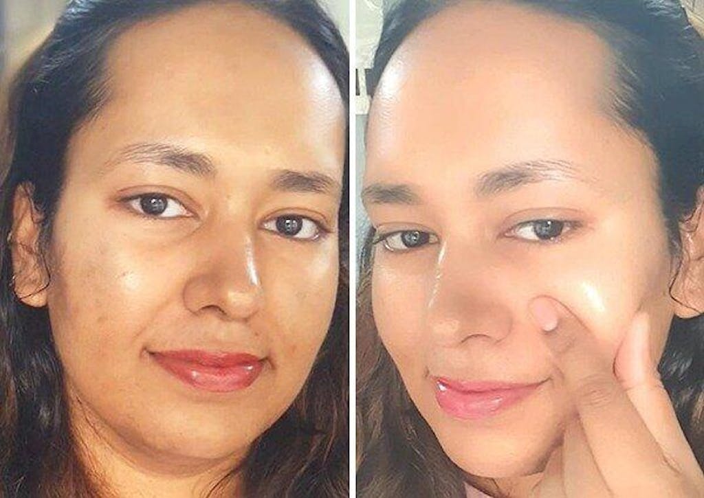 Brightening Depigmentation Gel for Reducing Pigmentation, Dark Spots ...