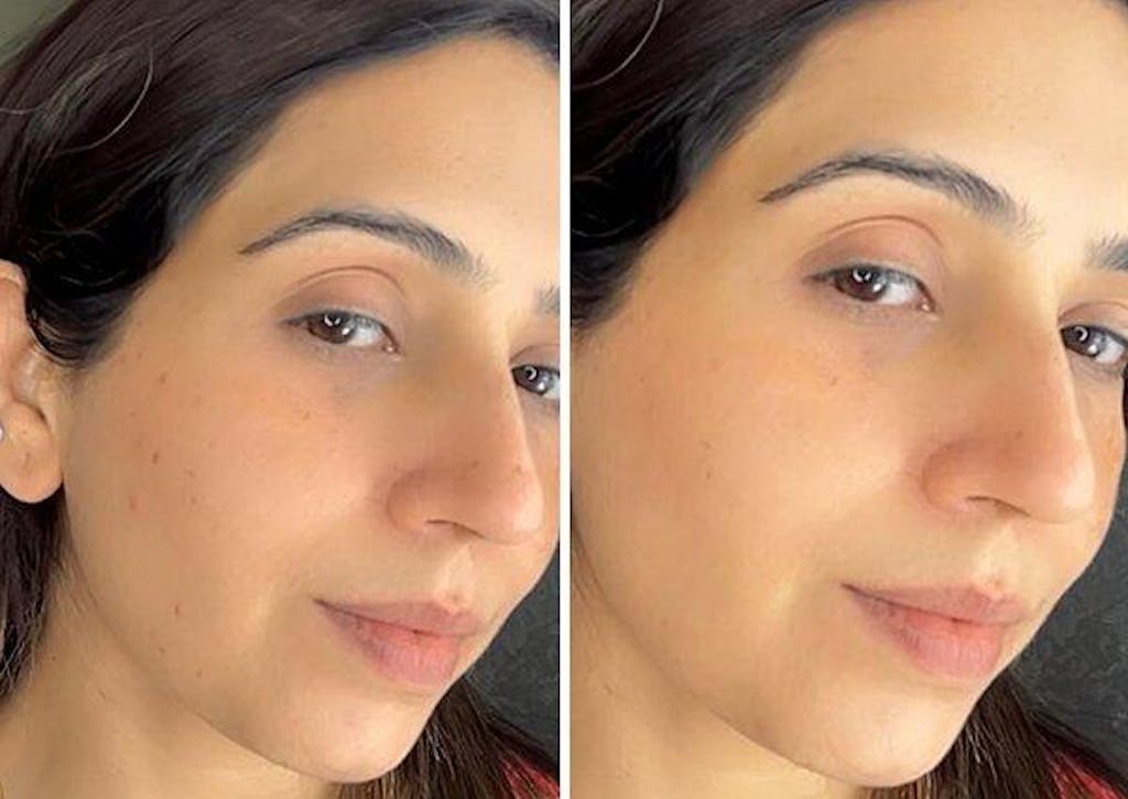 Brightening Depigmentation Gel for Reducing Pigmentation, Dark Spots ...