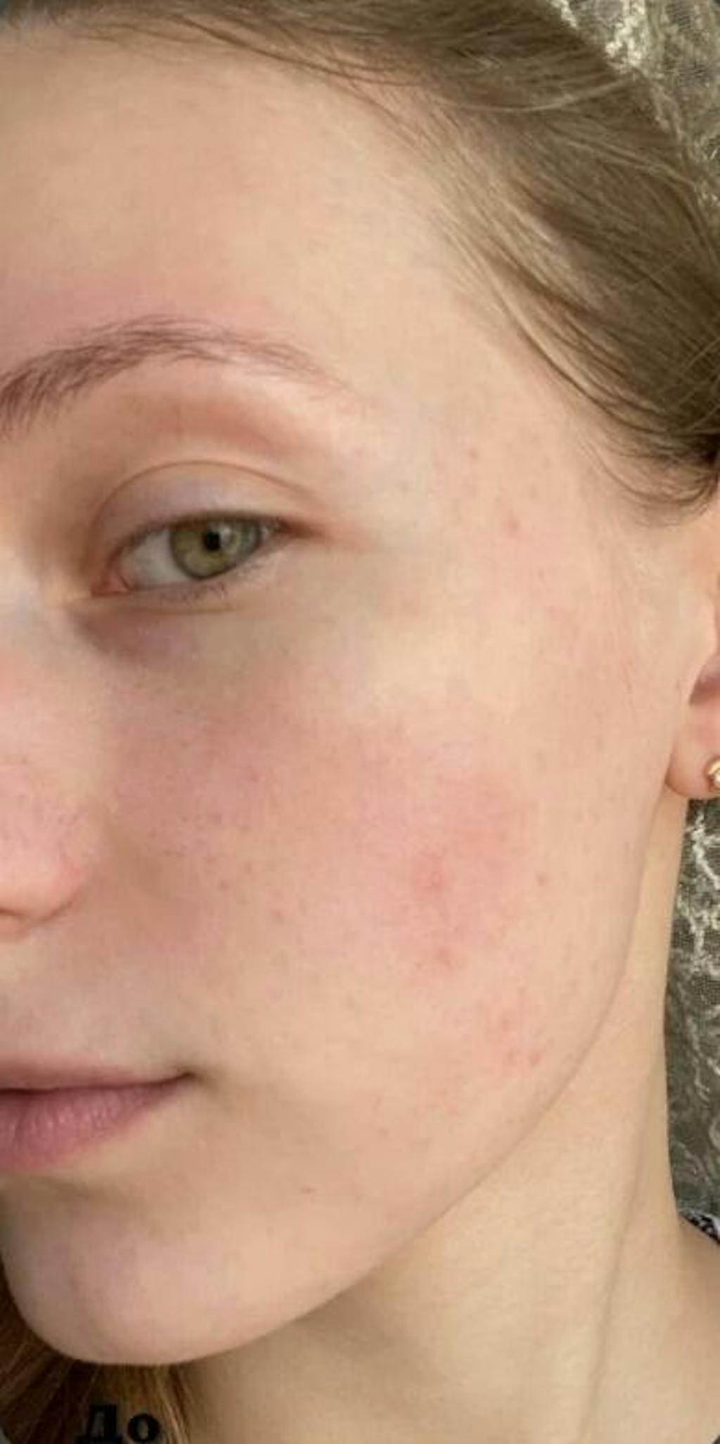 L&L SKIN LED Light Therapy Face Mask | Anti-aging | Acne-Clearing – Japan LL Skin Tech Co., Limited