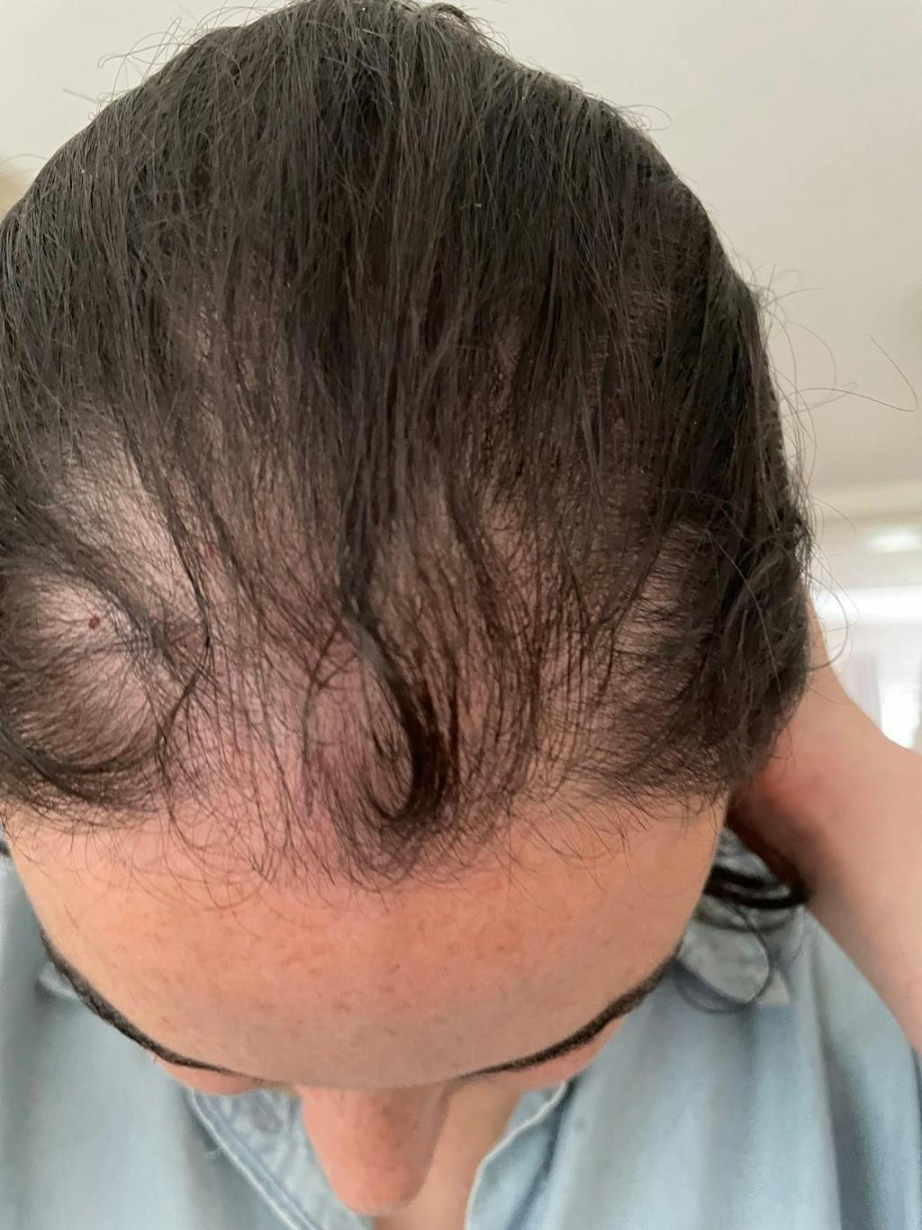 Hair Essence | Hair Growth Serum For Women & Men - KIWABI