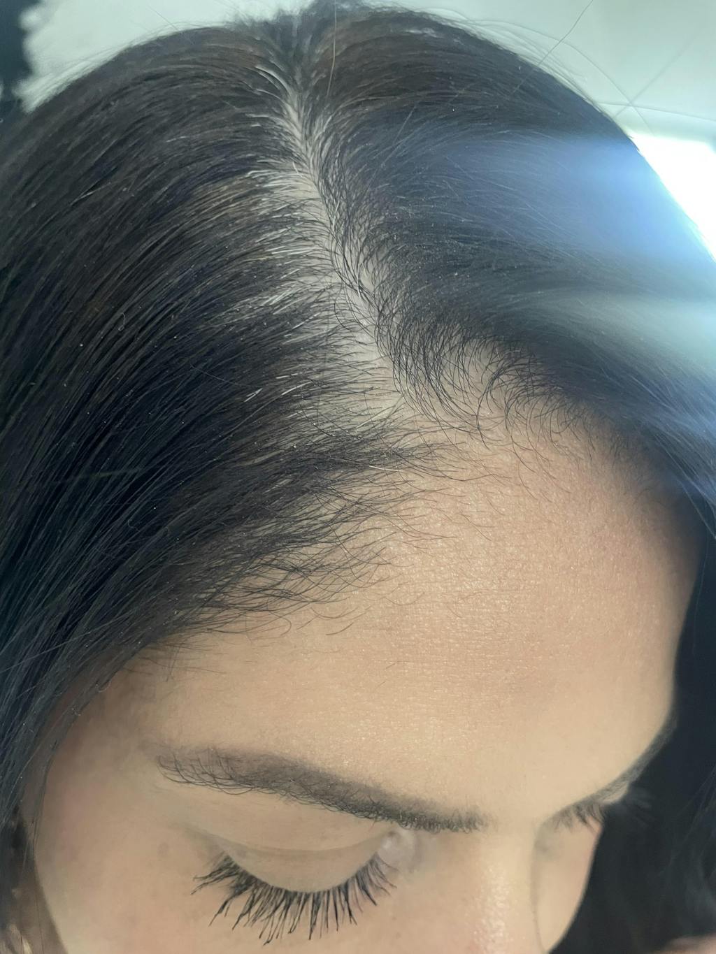 KYIR Fuller Active Hair Serum | Patented Science-Backed Hair Care – Kyir