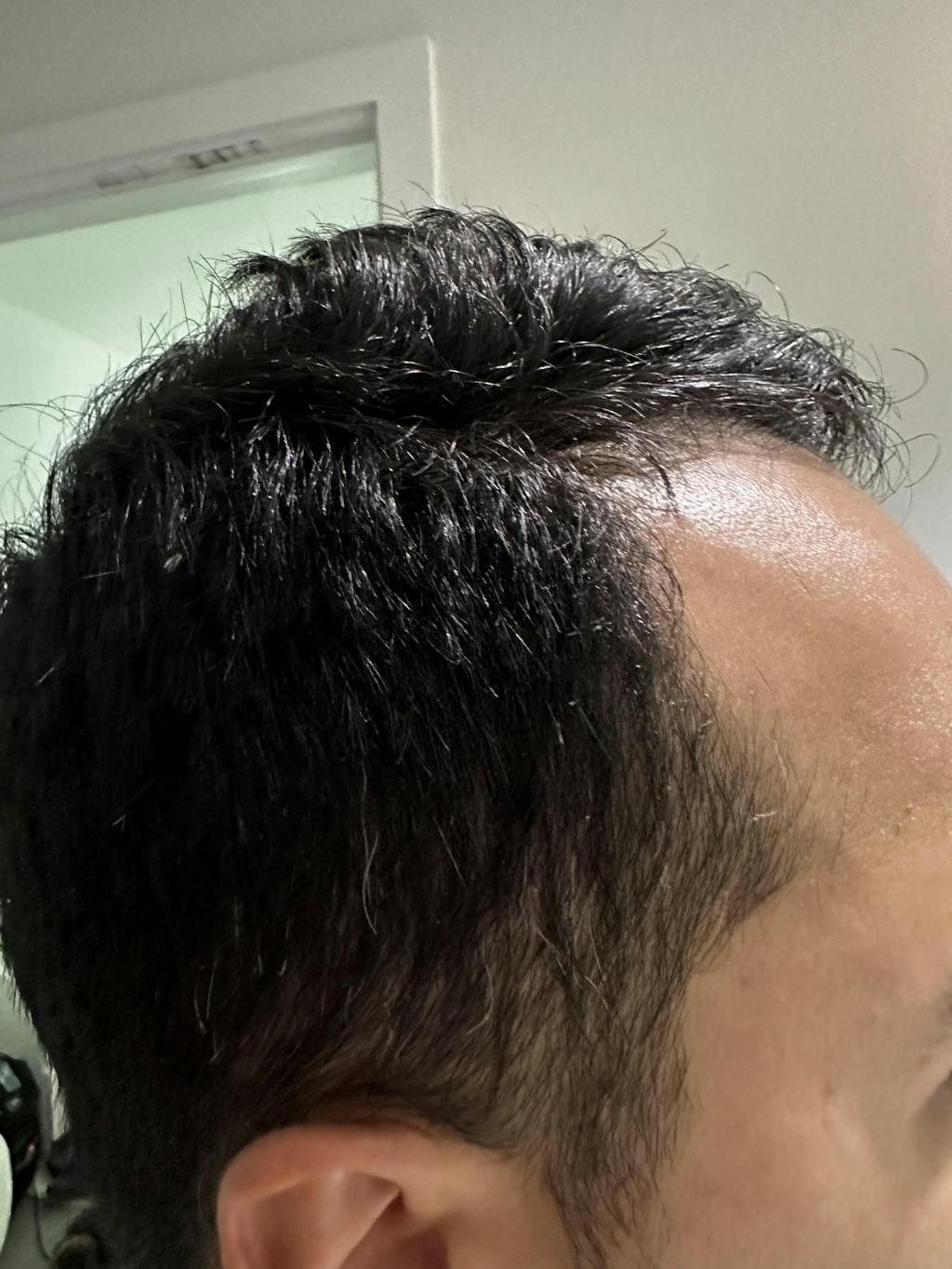 KYIR Fuller Active Hair Serum | Patented Science-Backed Hair Care – Kyir