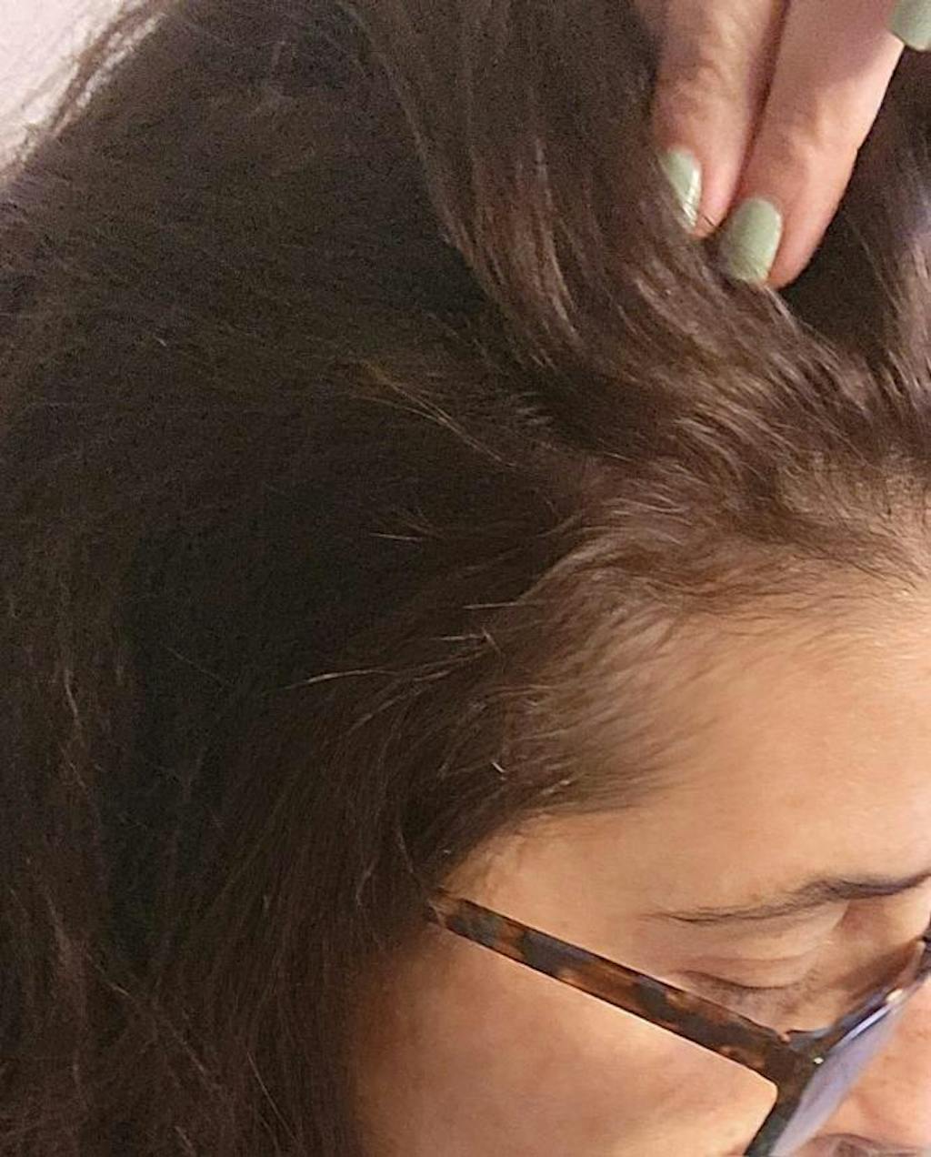 KYIR Fuller Active Hair Serum | Patented Science-Backed Hair Care - 10% ...