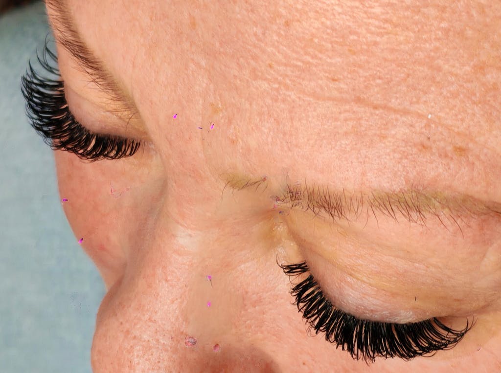 **The Importance of Patch Testing in Lash Extensions: A Guideline for