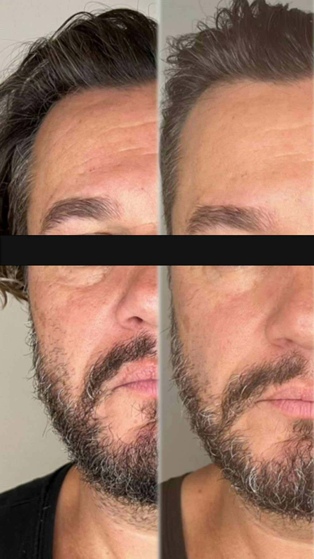 LED Full Body Dome - GloDome – LightLab Beauty