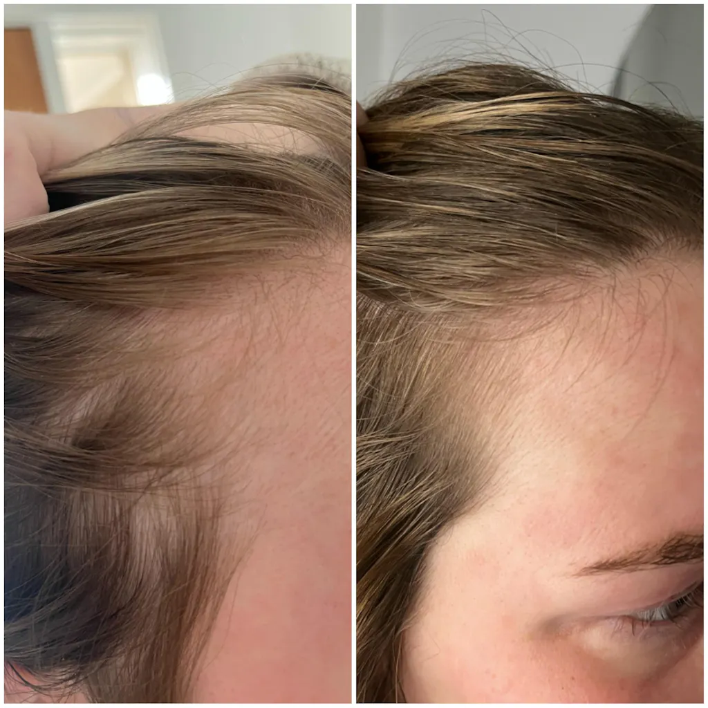 Liquid Locks Hair Growth Serum