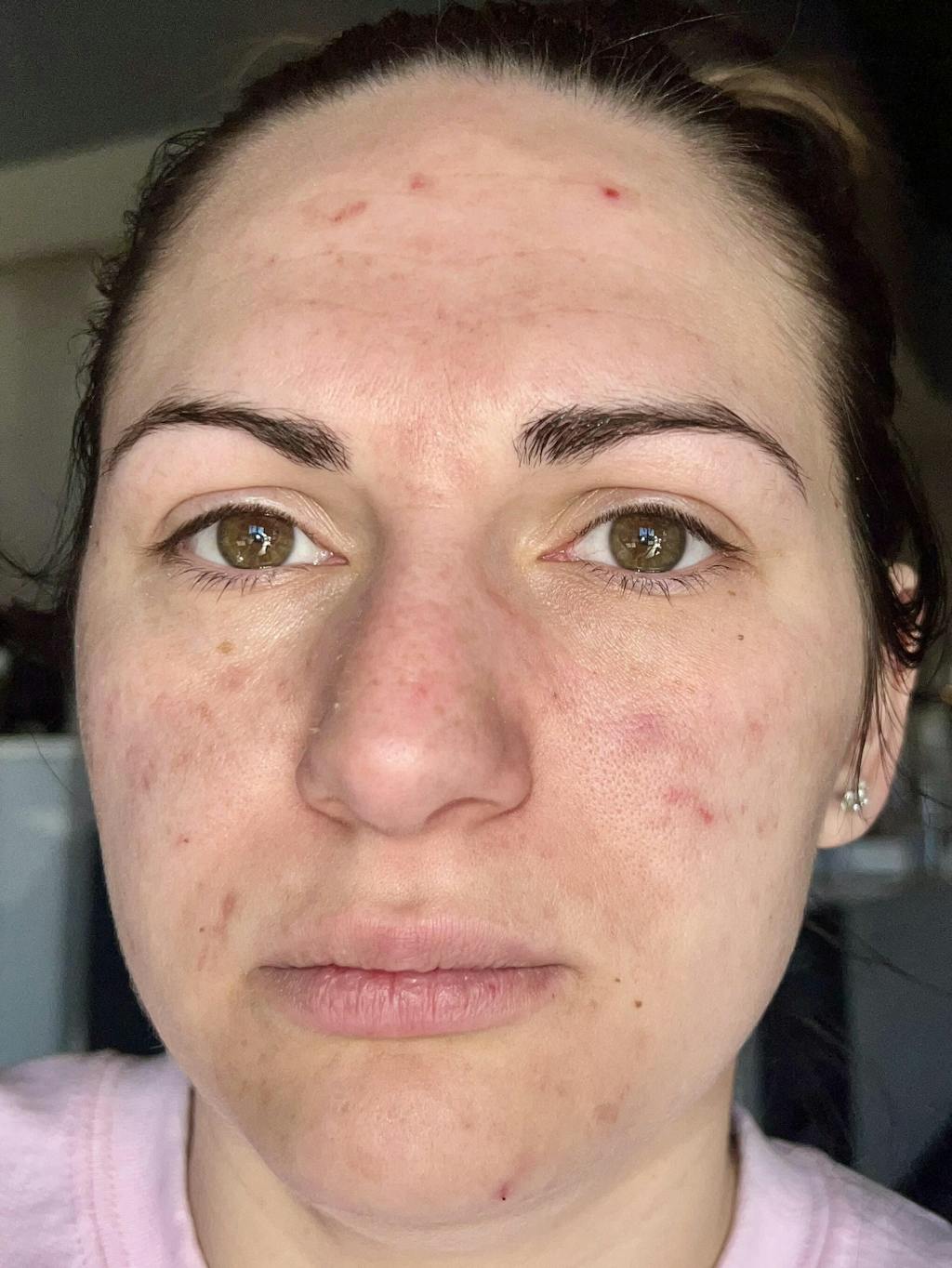 Glow Enzyme- Beauty Pops Frozen Face Mask KIT – Love and pebble