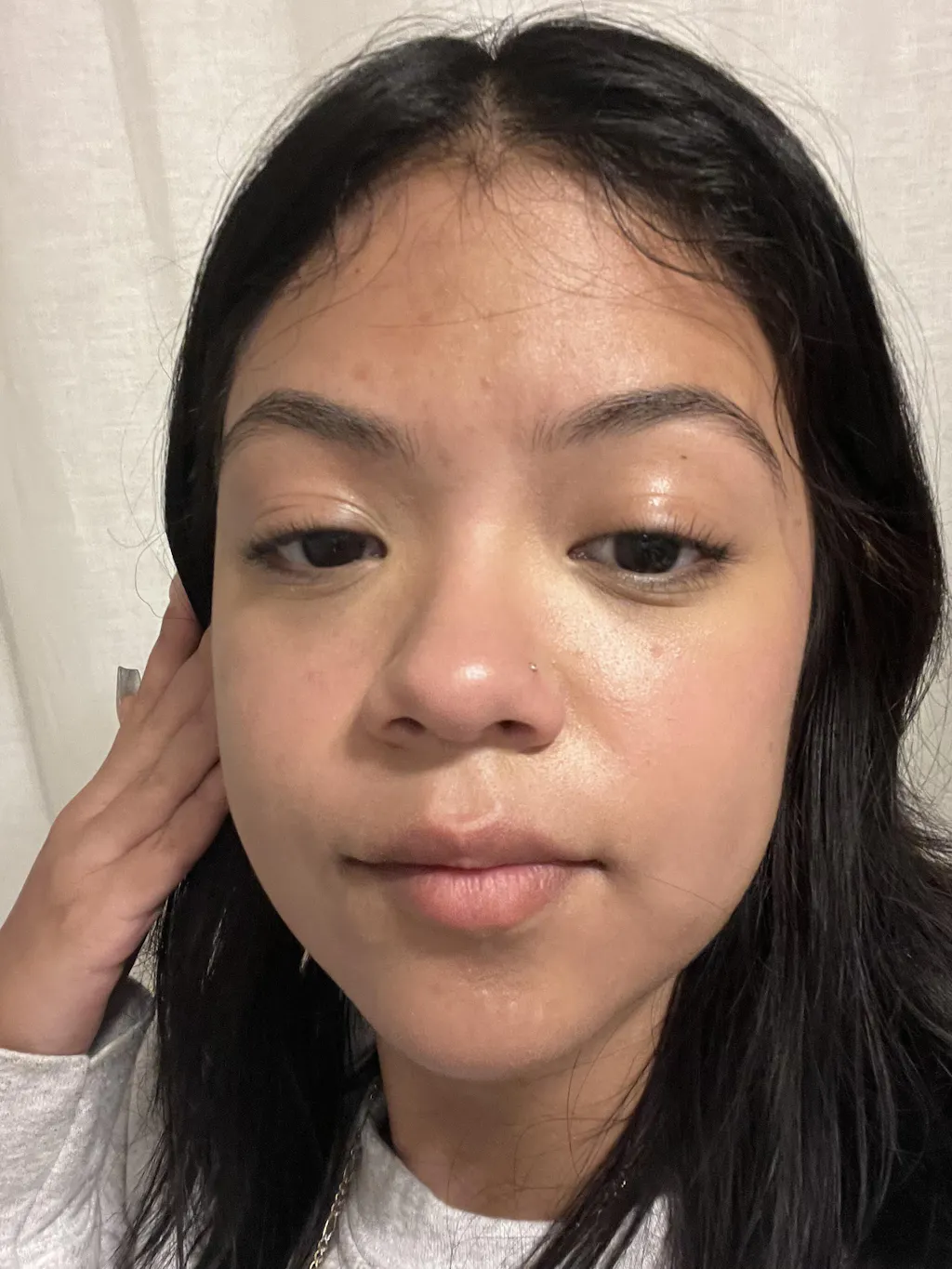 Malezia Acne Treatment Gel | Fungal Acne Safe