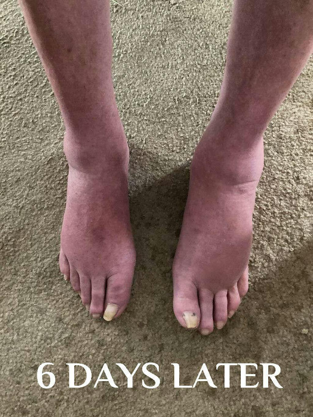 Lymphatic Support Herbal Liquid Supplement – MaryRuth Organics