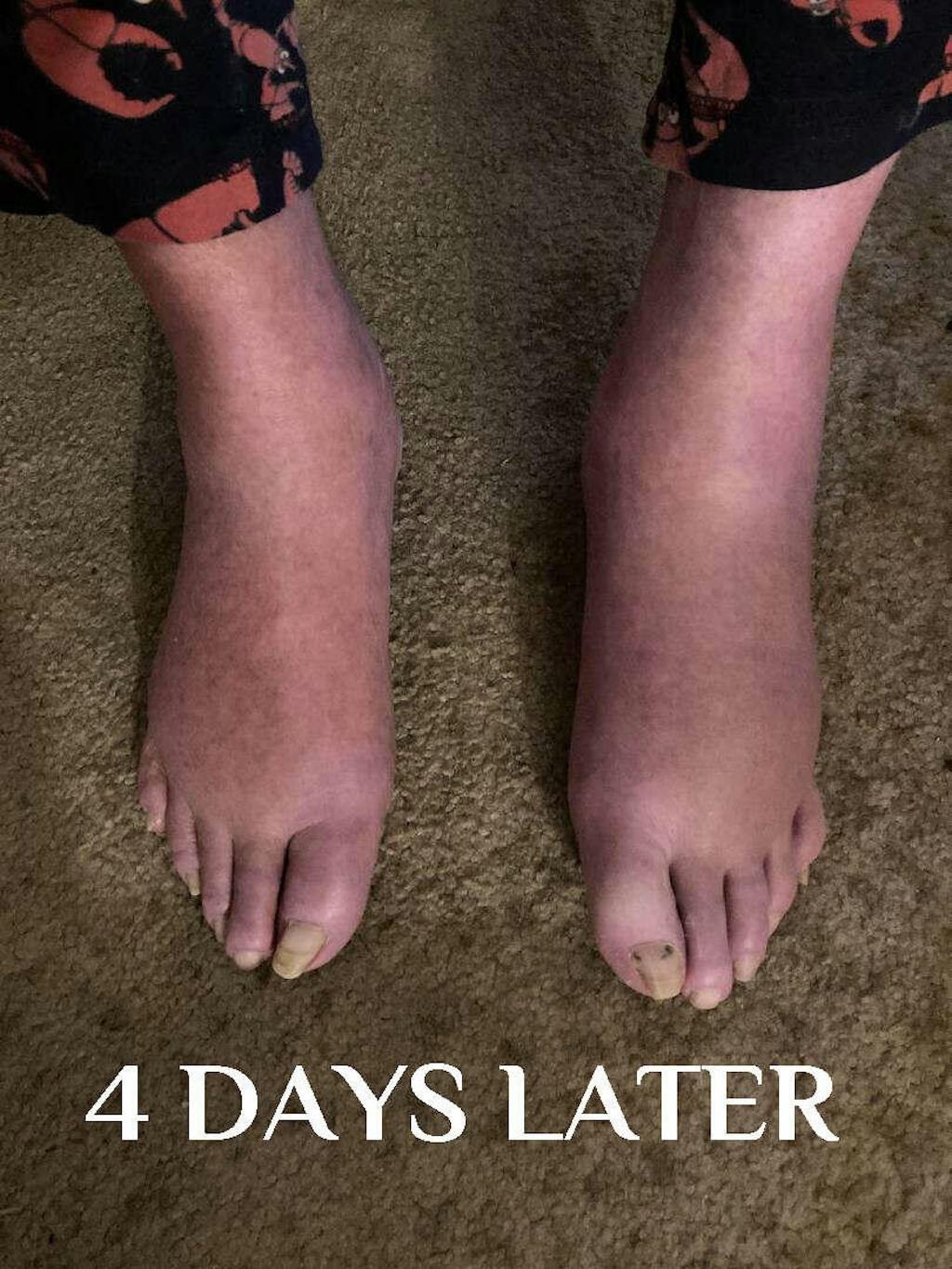 Lymphatic Support Herbal Liquid Supplement – MaryRuth Organics