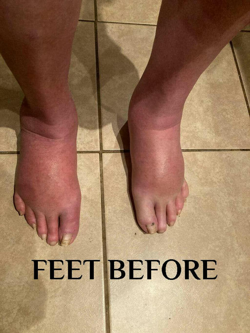 Lymphatic Support Herbal Liquid Supplement – MaryRuth Organics