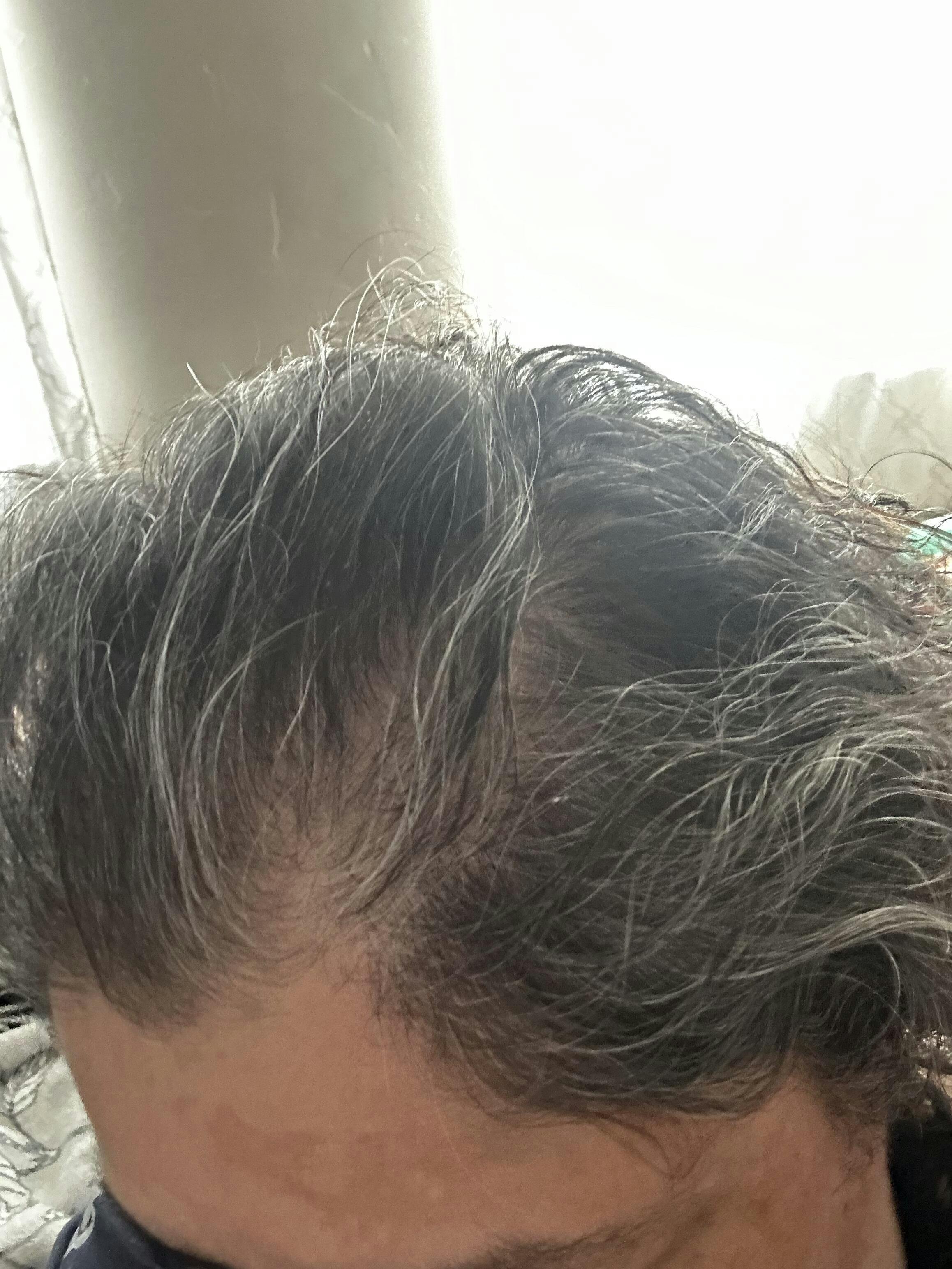 Liquid Morning Multivitamin + Hair Growth Vitamin Supplement – MaryRuth ...