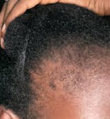 Ayurvedic Hair Growth Oil – Meeno Cosmetics