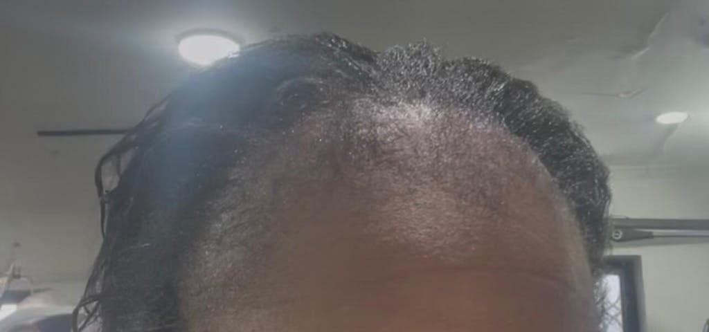 Meeno Cosmetics | Natural Plant-based Hair Growth Remedies