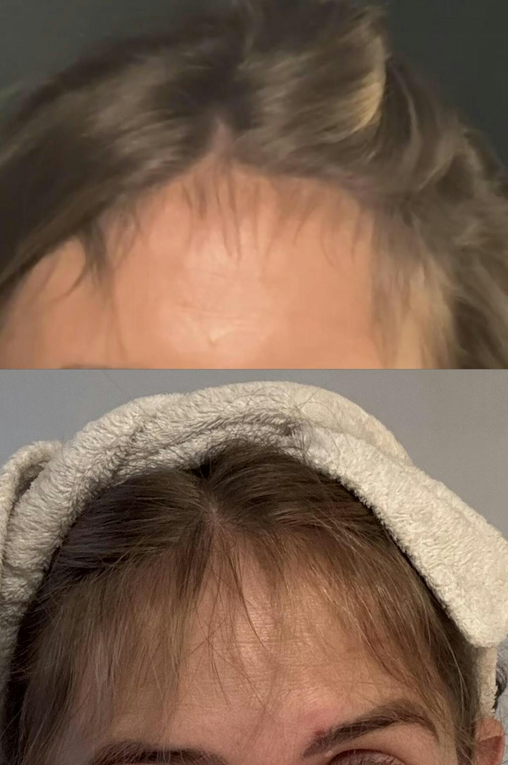 Nº. 1 Transformative Mask – MMR Beauty