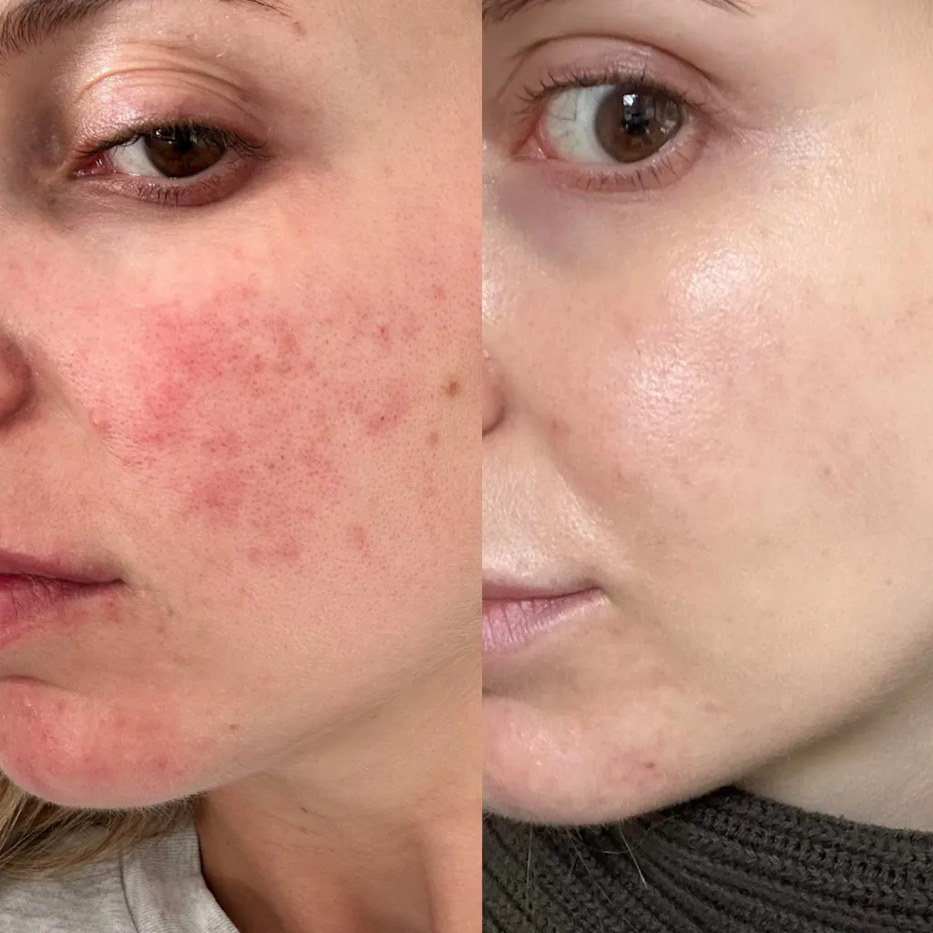 The Powder - Enzyme Exfoliant – Monday Muse
