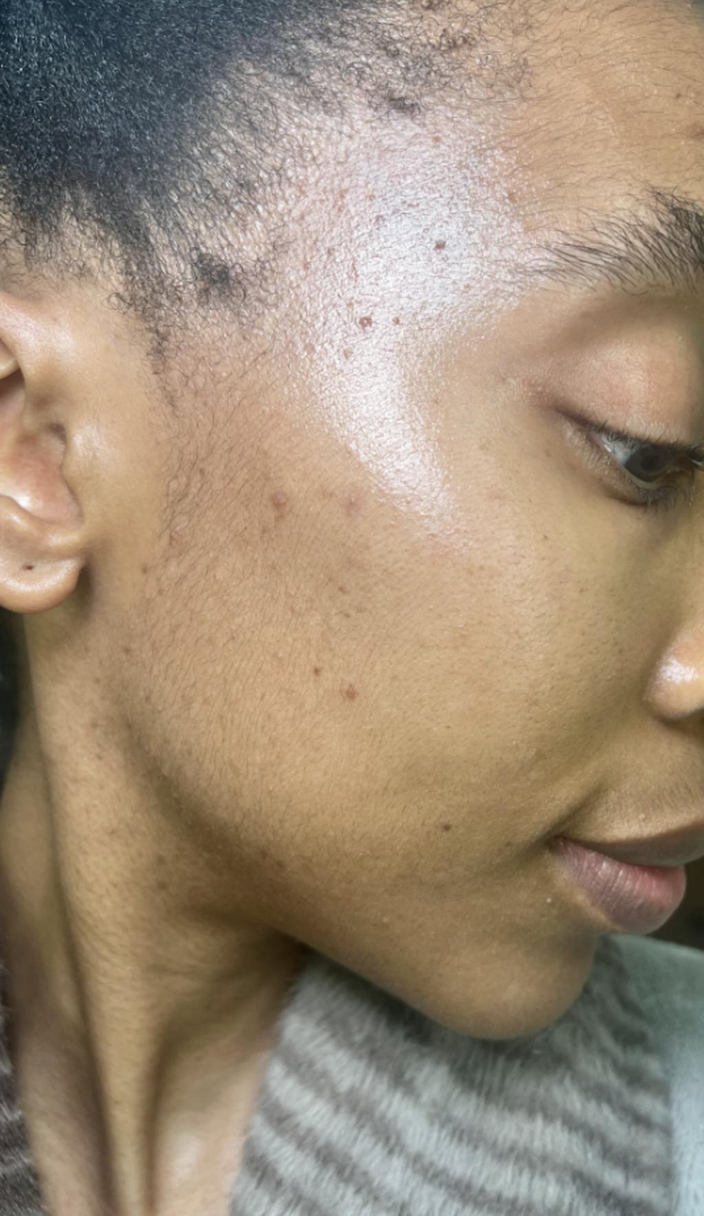 Pigmentation Fade Bundle – Monday Muse