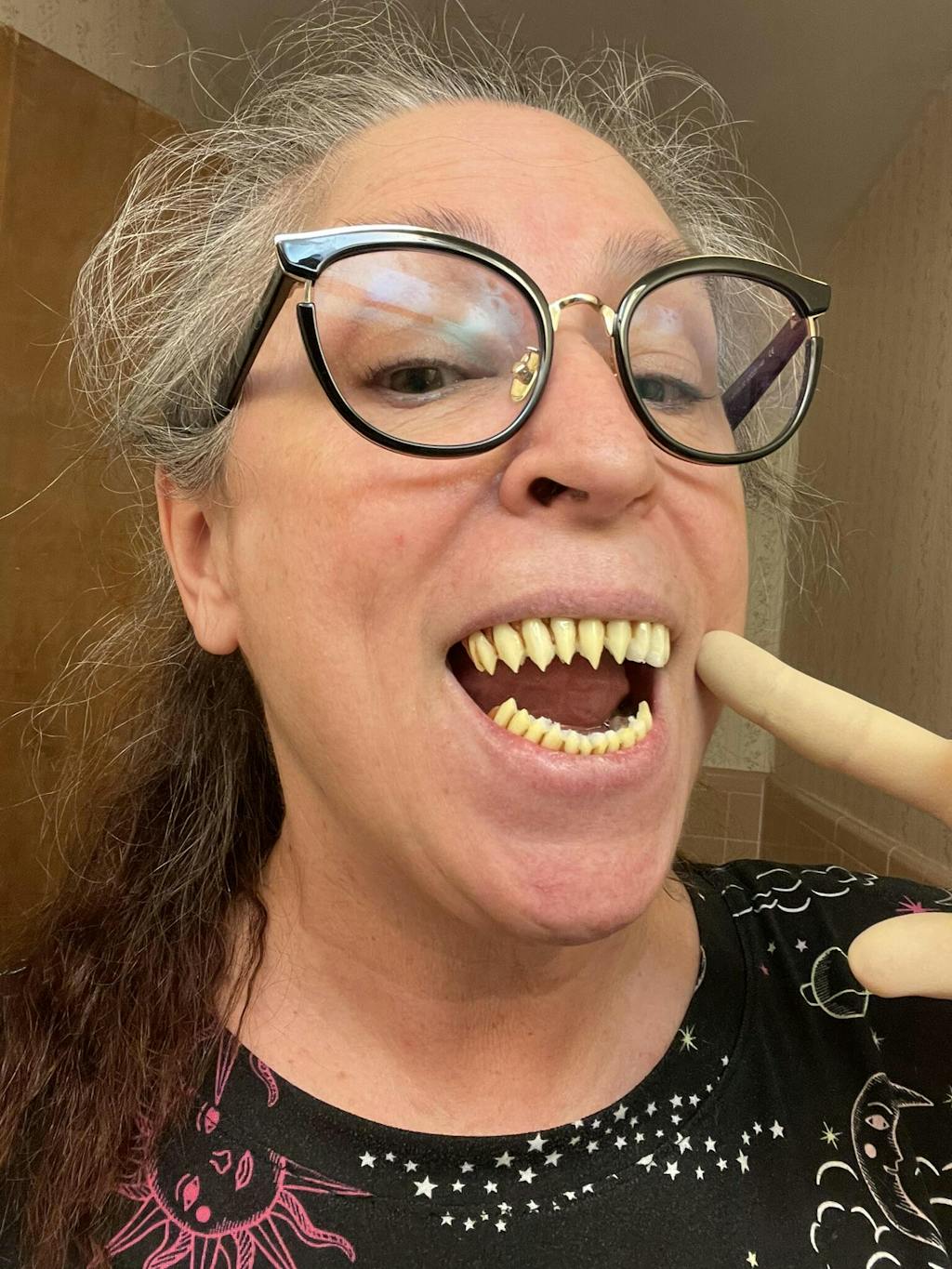 Pennywise Teeth - custom fit teeth | MostlyDead.com