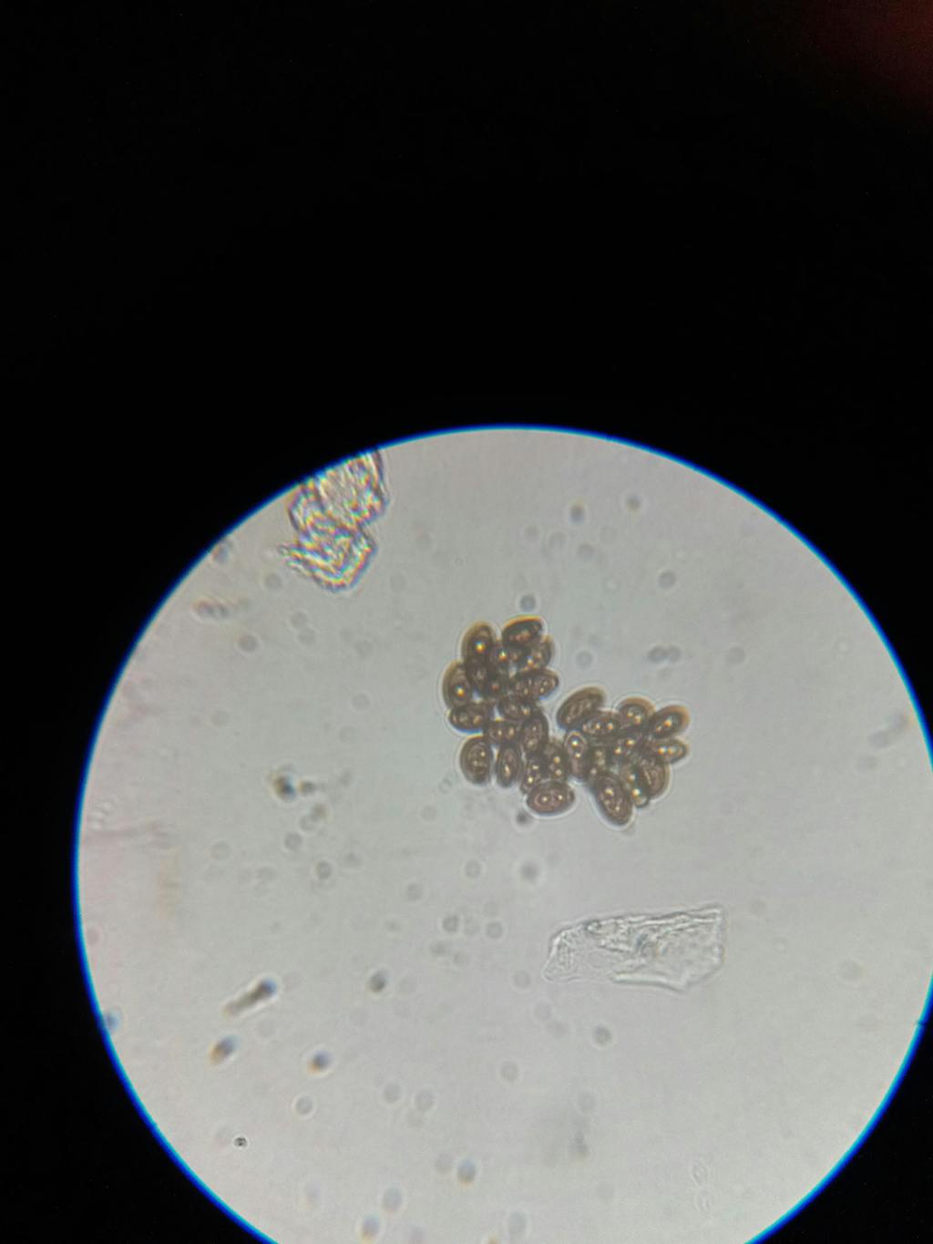 Beginner Friendly 6X Spore Syringe Vendor’s Choice Pack – Mushroom Man ...