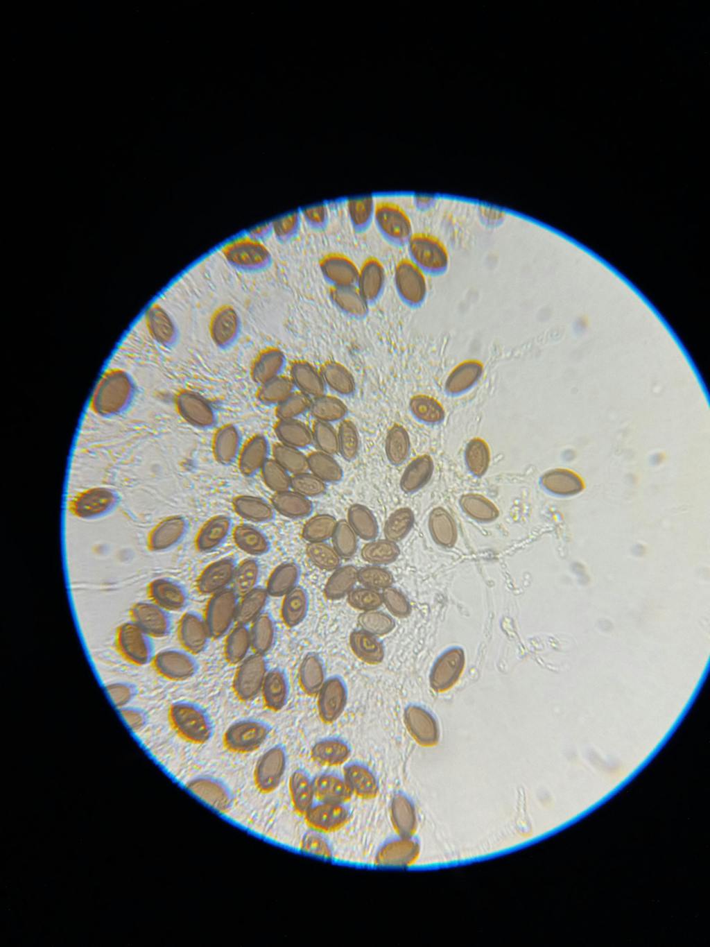 Beginner Friendly 6X Spore Syringe Vendor’s Choice Pack – Mushroom Man ...