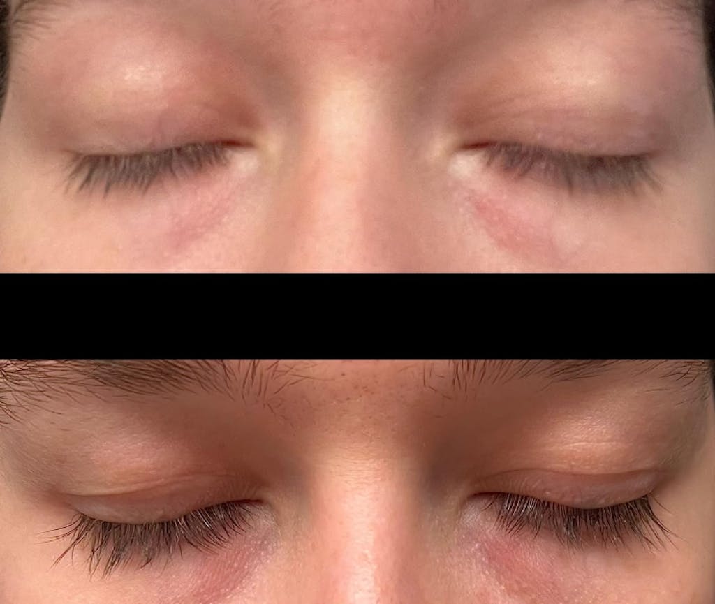 MUSKD™ Lash Enhancer