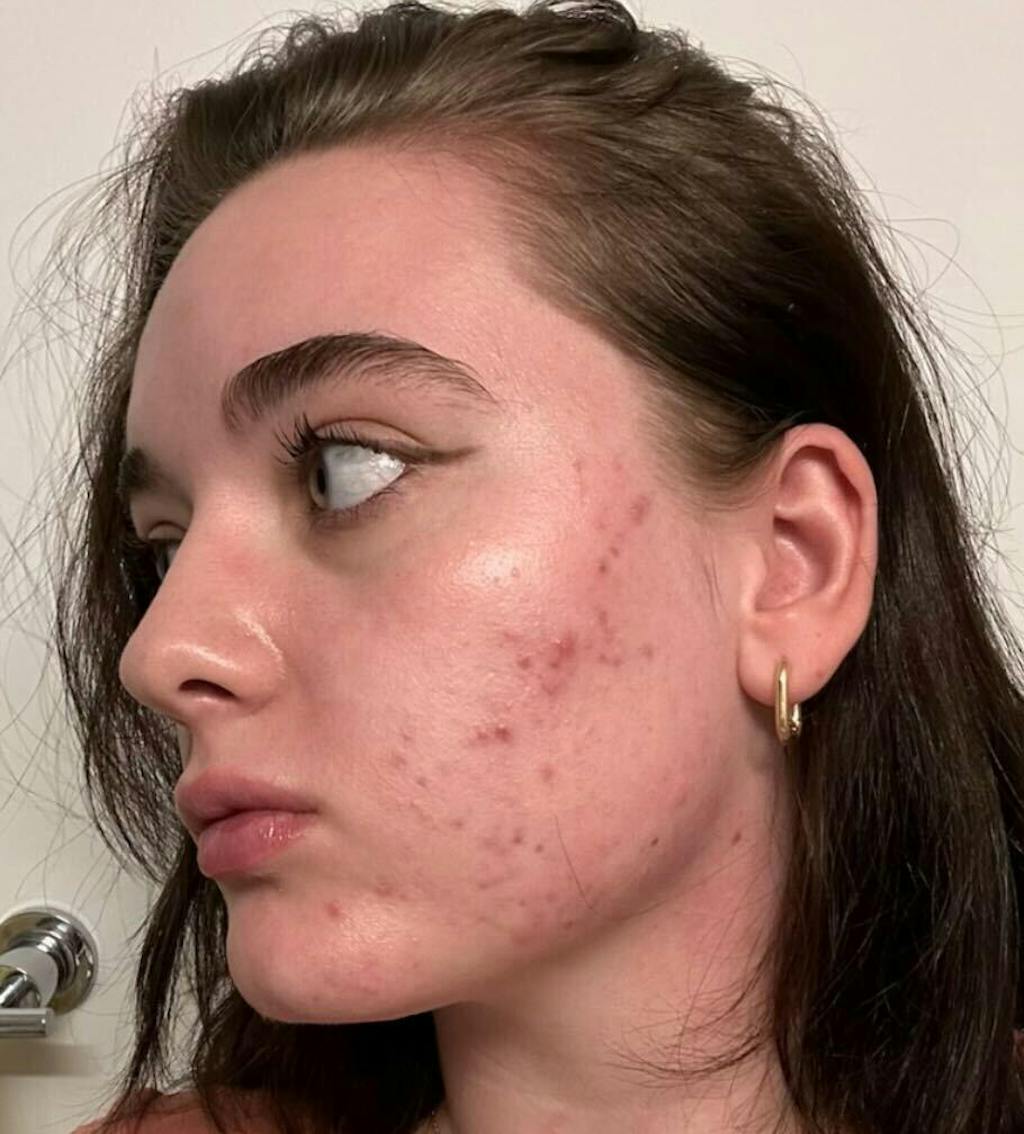 My Sheen Skin Nora LED Light Therapy Face Mask