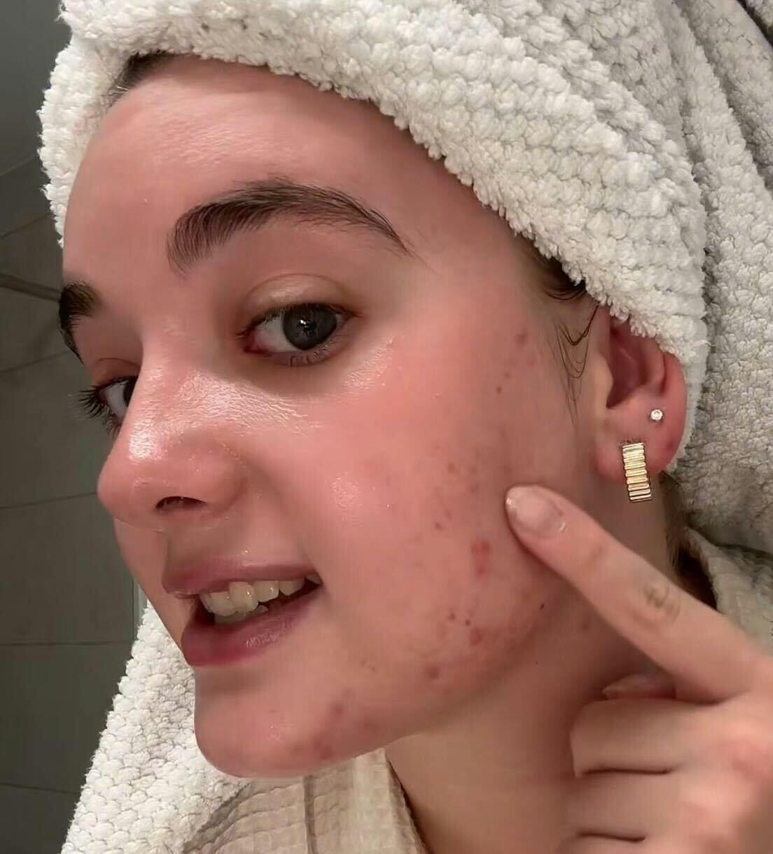 My Sheen Skin Nora LED Light Therapy Face Mask