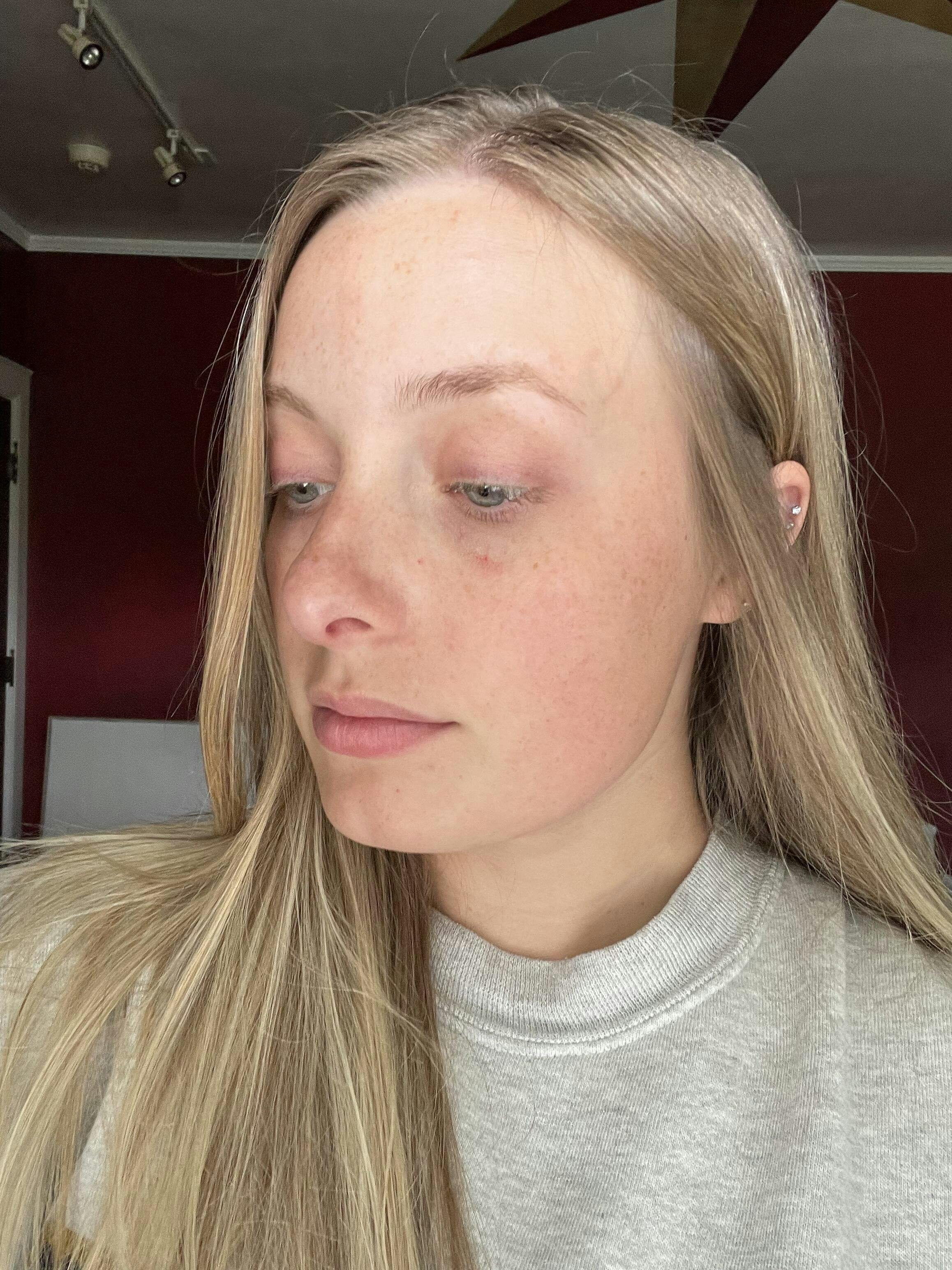 My Sheen Skin Nora LED Light Therapy Face Mask