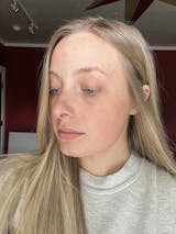 My Sheen Skin Nora LED Light Therapy Face Mask