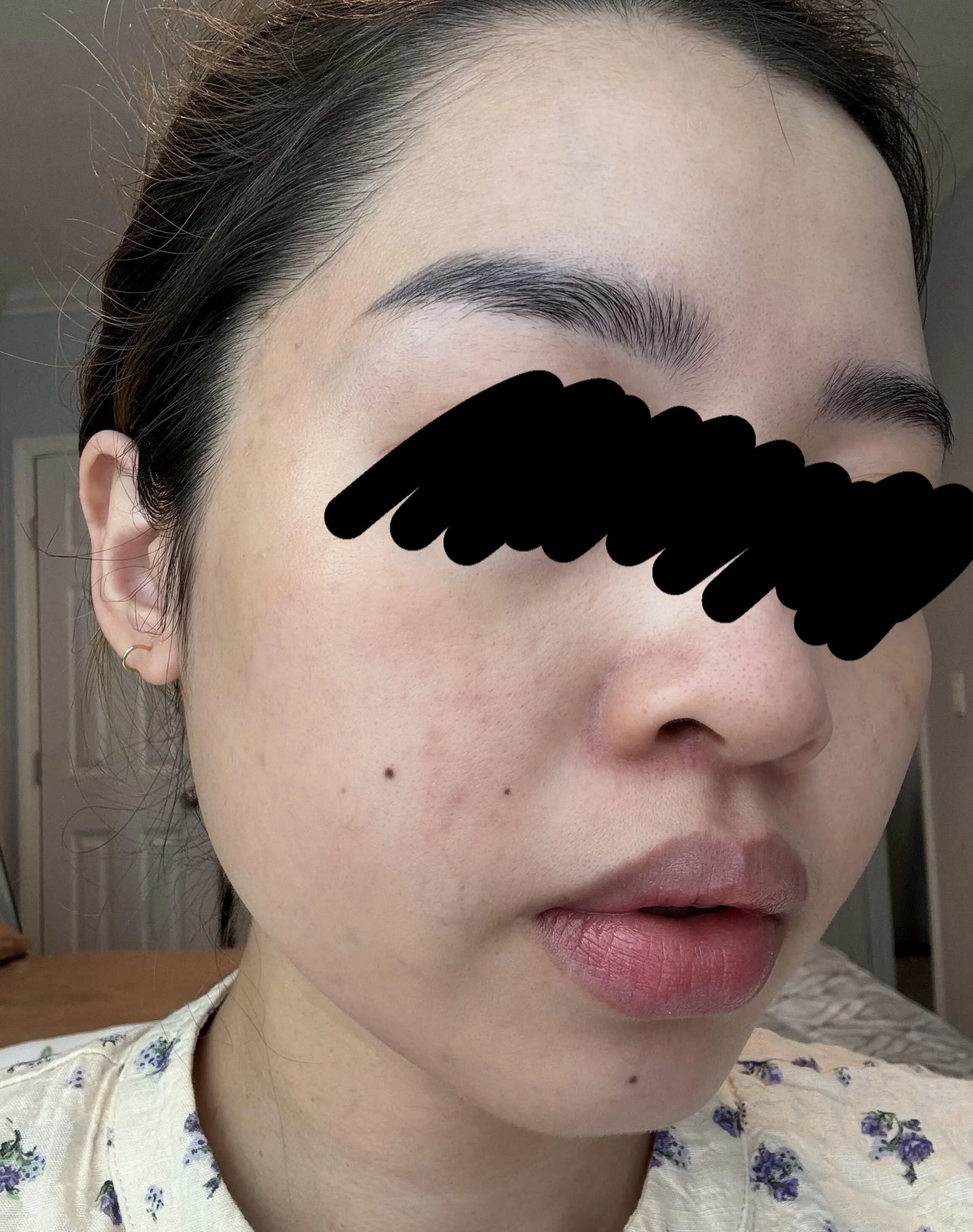 My Sheen Skin Nora LED Light Therapy Face Mask