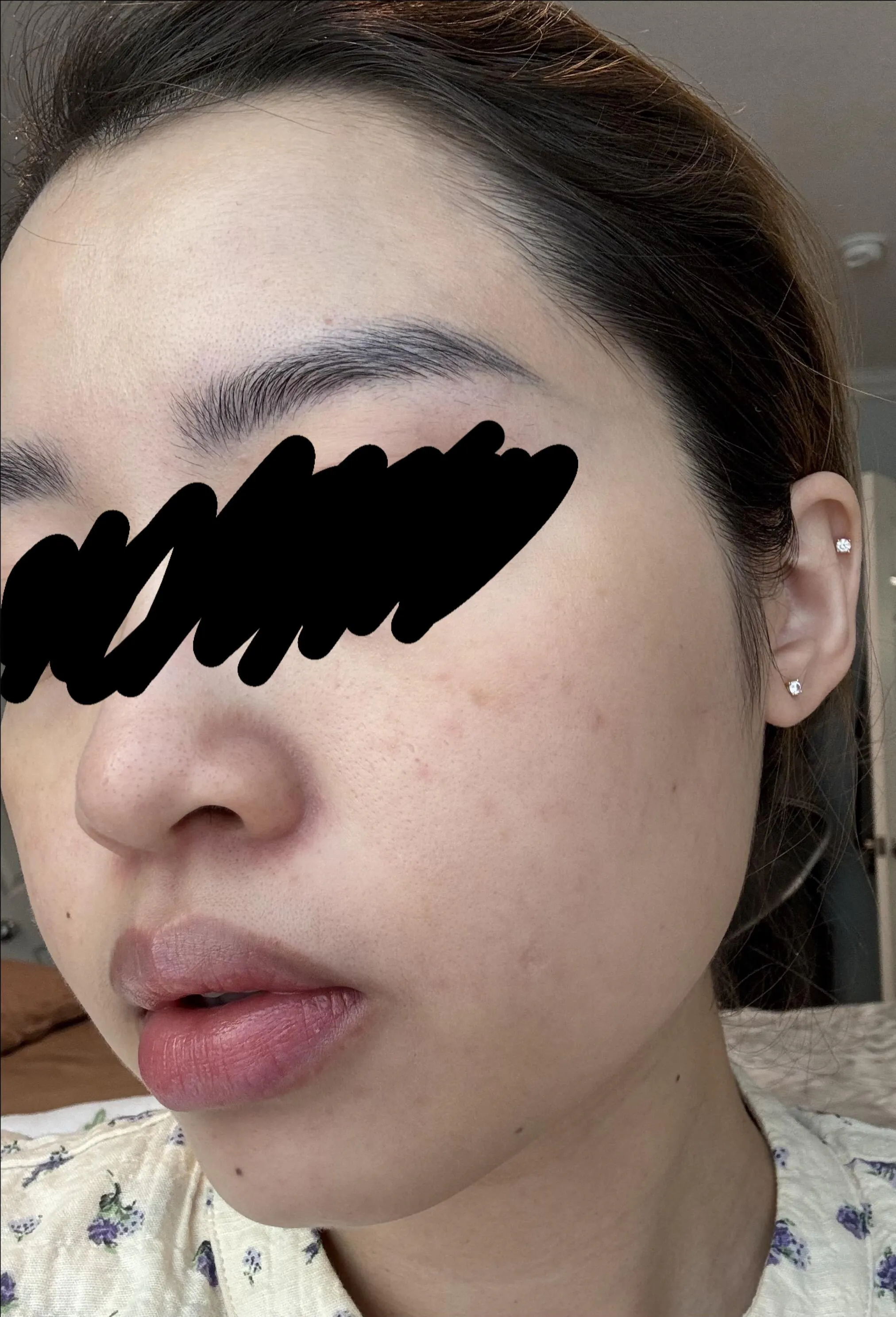 My Sheen Skin Nora LED Light Therapy Face Mask