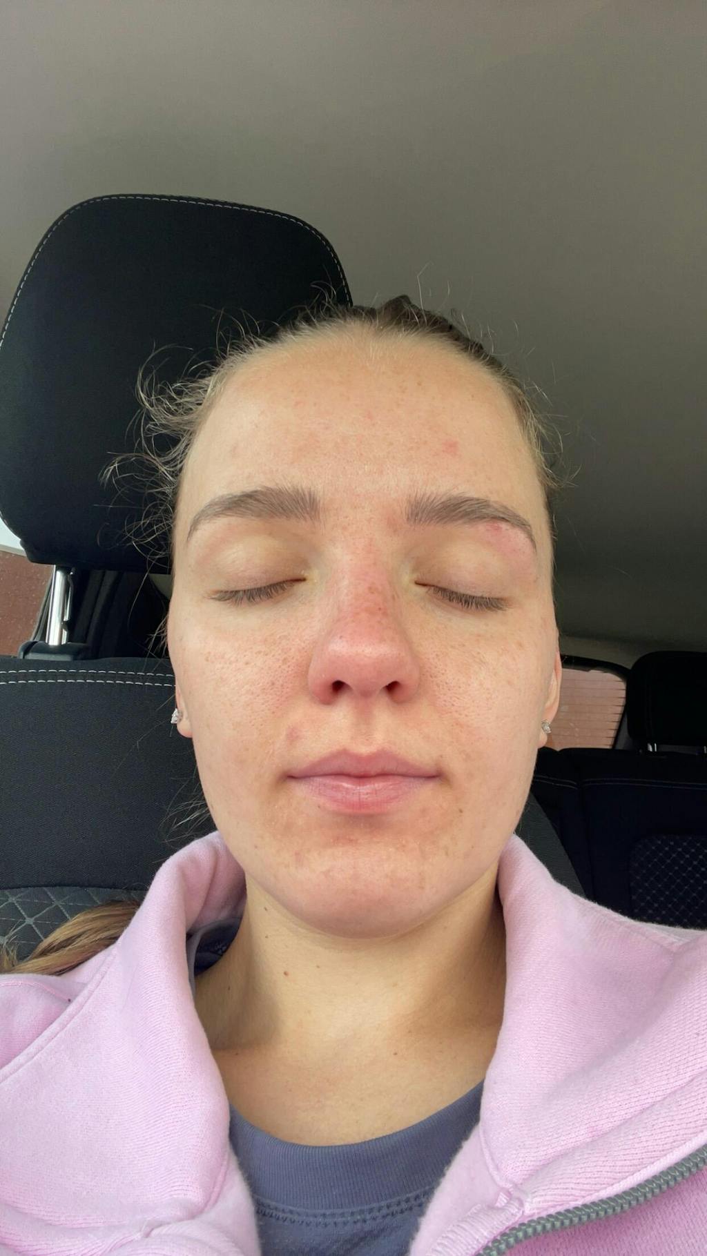 My Sheen Skin Nora LED Light Therapy Face Mask