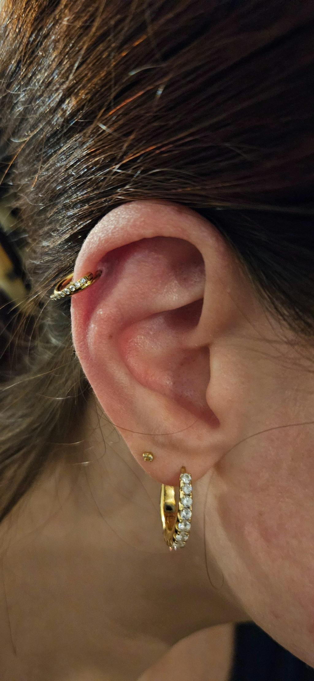 Chéloïde ou excroissance après un piercing : que faire ? – Naald Piercing