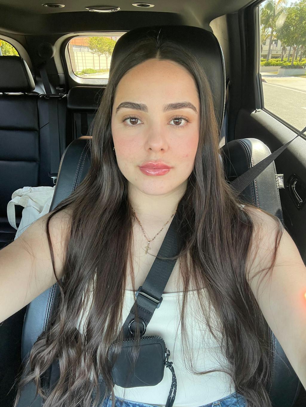 Lip Filler Lip Injections In California And Arizona Nakedmd Medspa