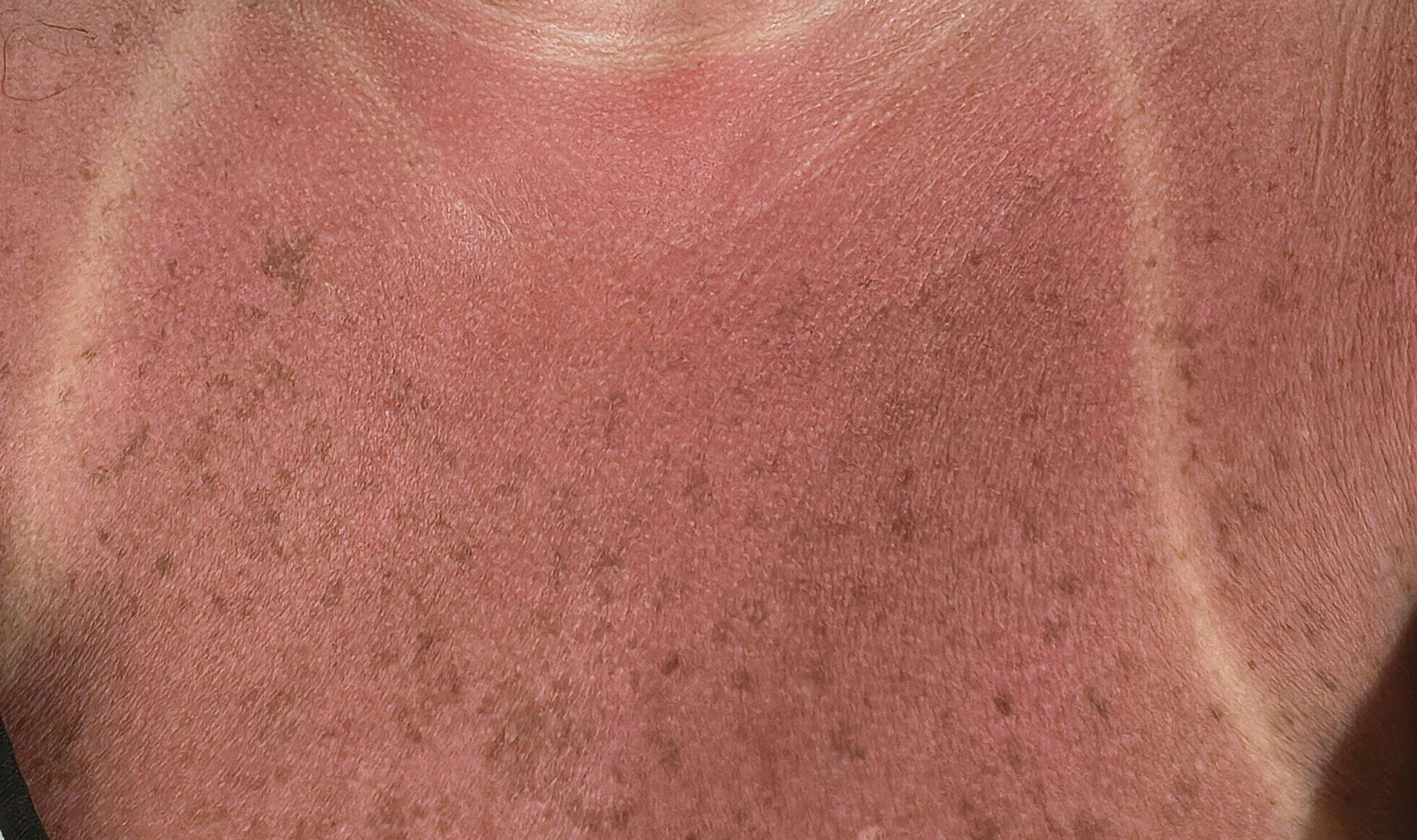 Óleo Corporal Gotas de Sol – Néctar Beleza Consciente