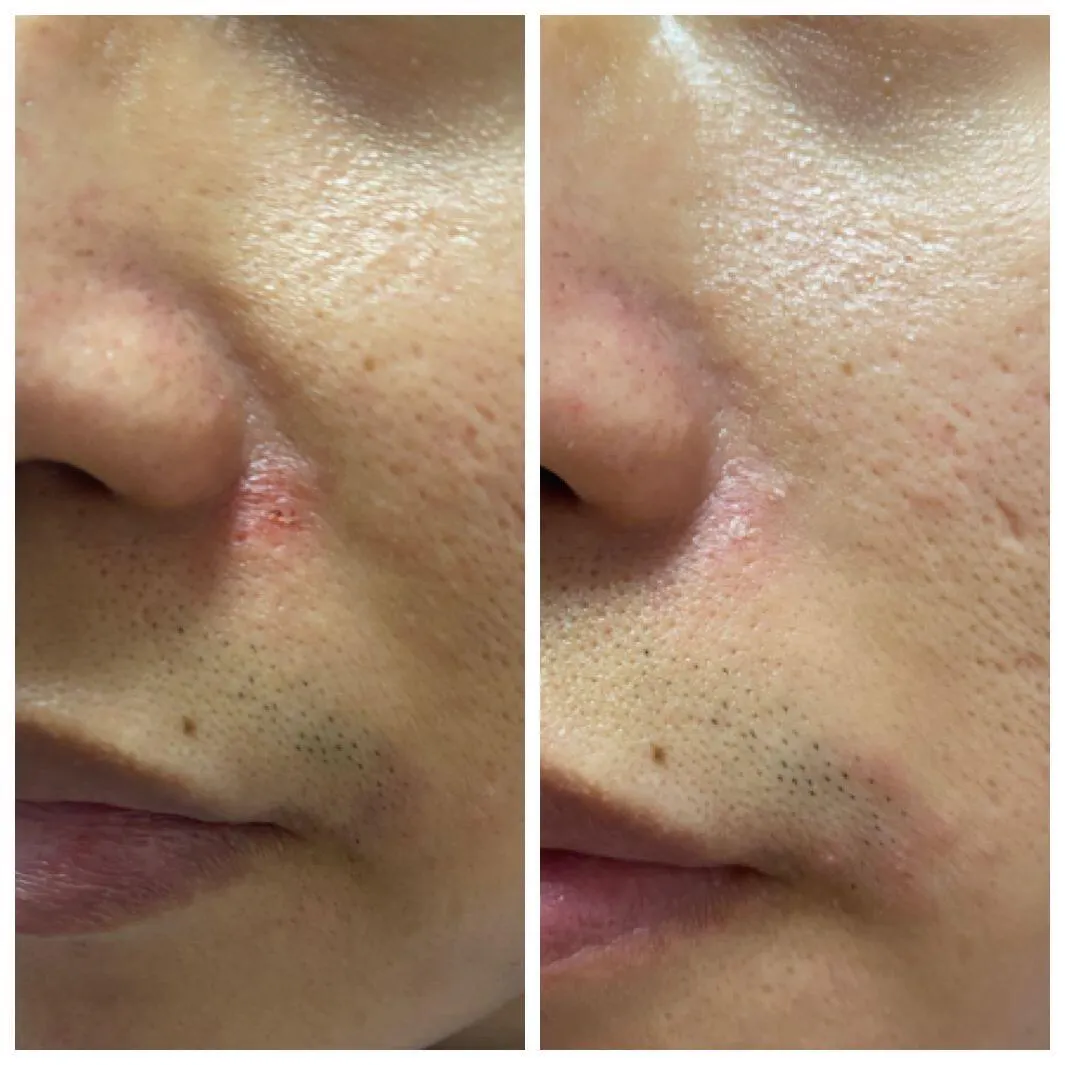 Intense Collagen Glow – NSJ Wellness Lifestyles Private Limited