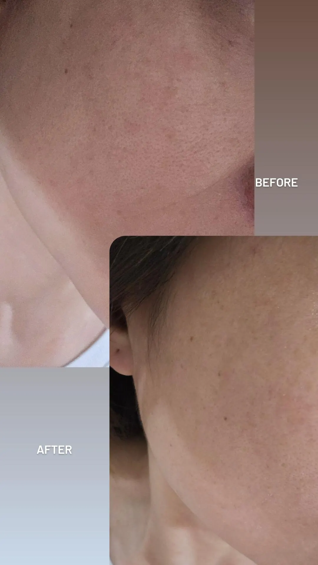 Intense Collagen Glow – NSJ Wellness Lifestyles Private Limited