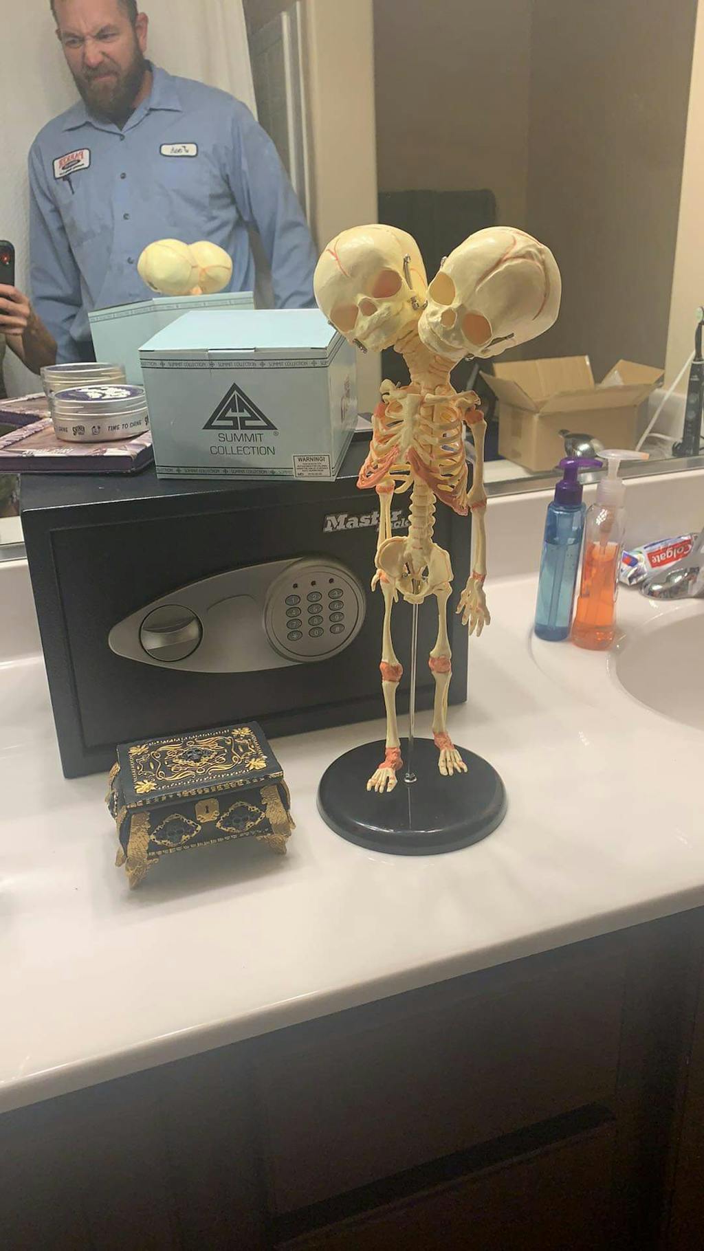 2 Headed Fetal Skeleton, Human Fetus Skeleton, Conjoined Twins Skeleton ...